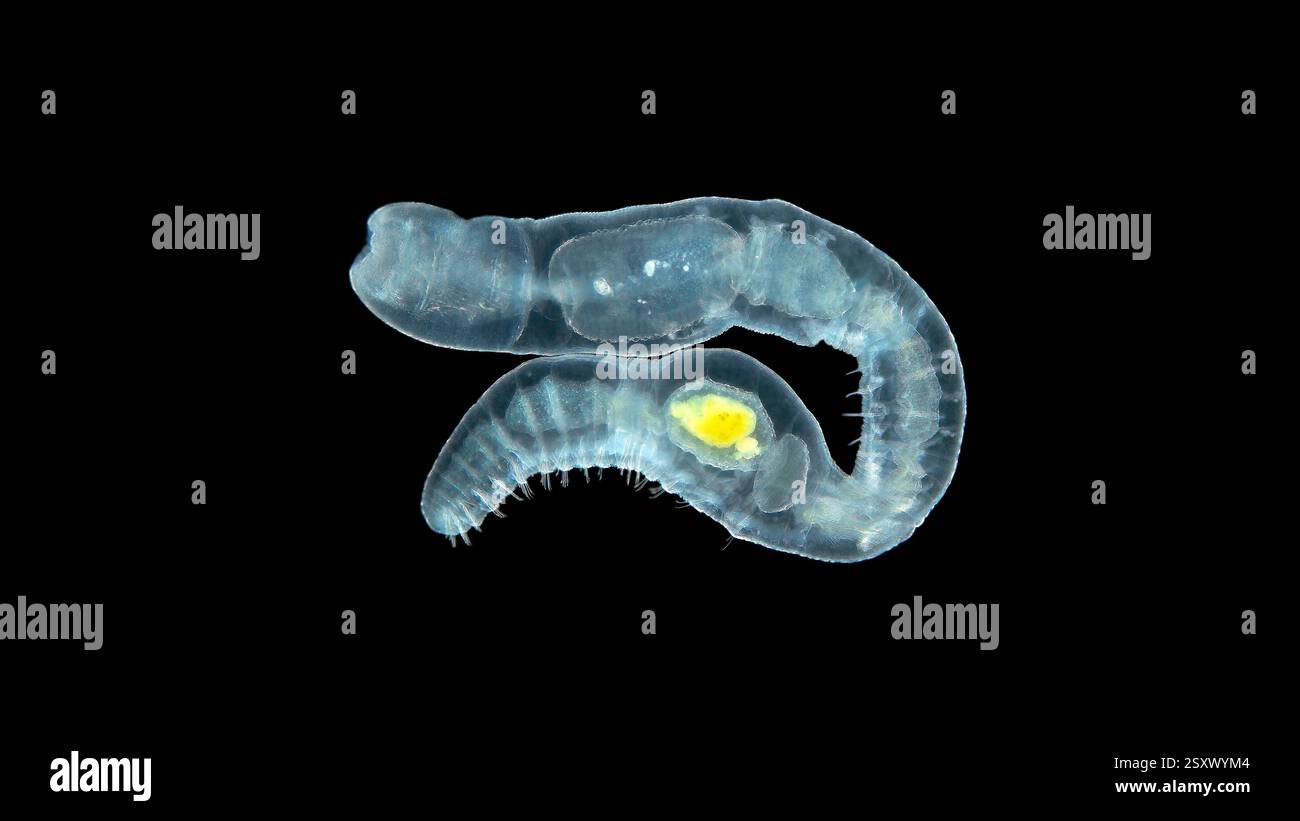 Light micrograph of a Chaetogaster sp. freshwater worm Stock Photo - Alamy