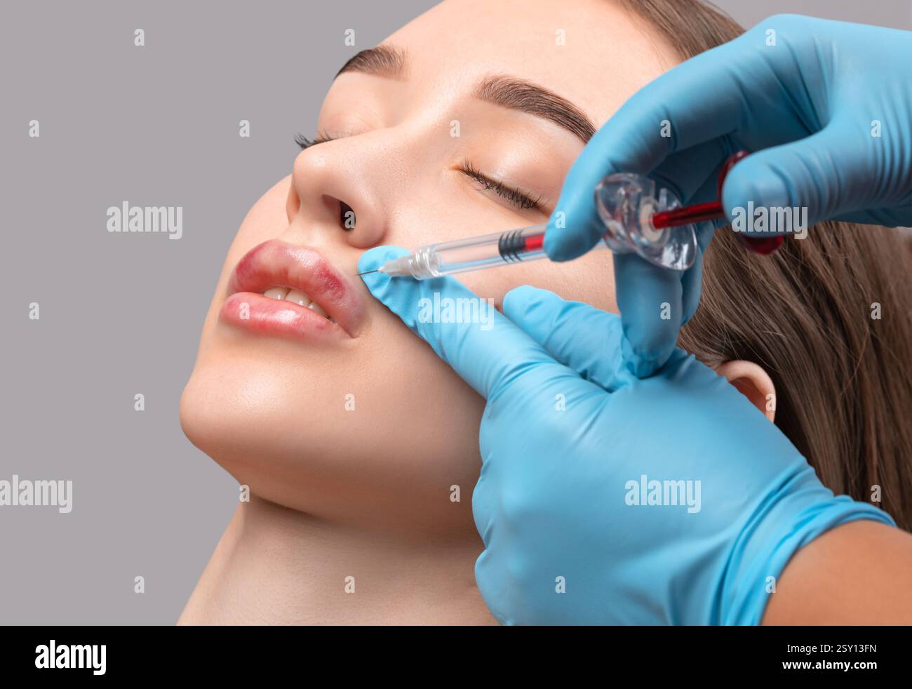 Cosmetologist does injections for lips augmentation anti wrinkle ...