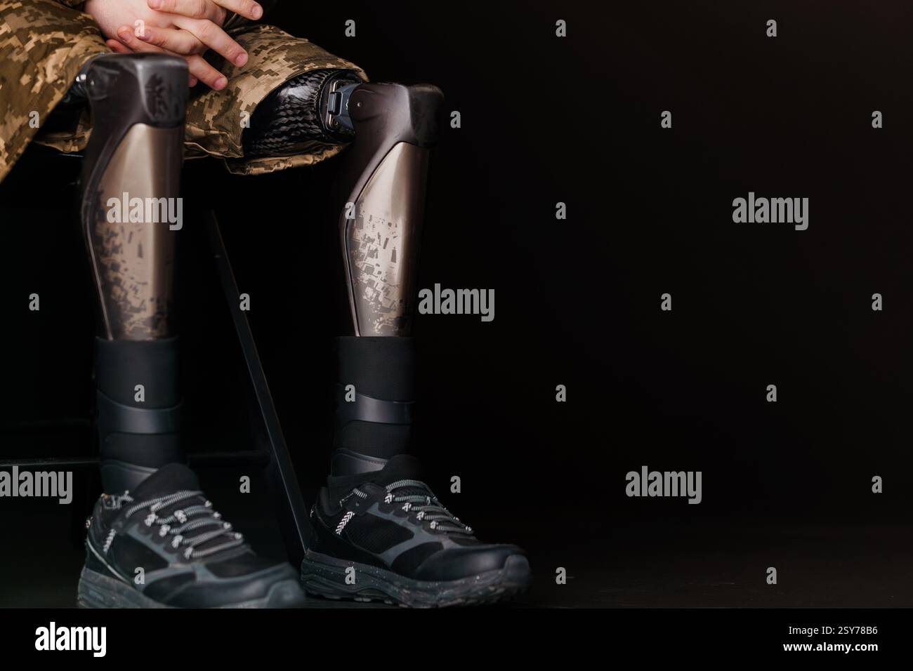 Man Wearing Bionic Leg Prosthesis in Military Informed Outfit Stock ...