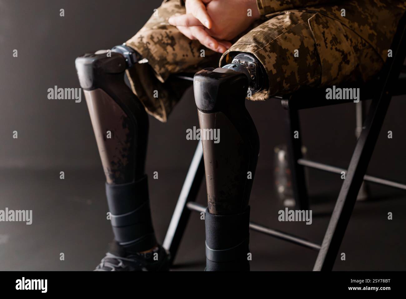 Resilient Soldier with Advanced Bionic Leg Prosthesis in Military ...