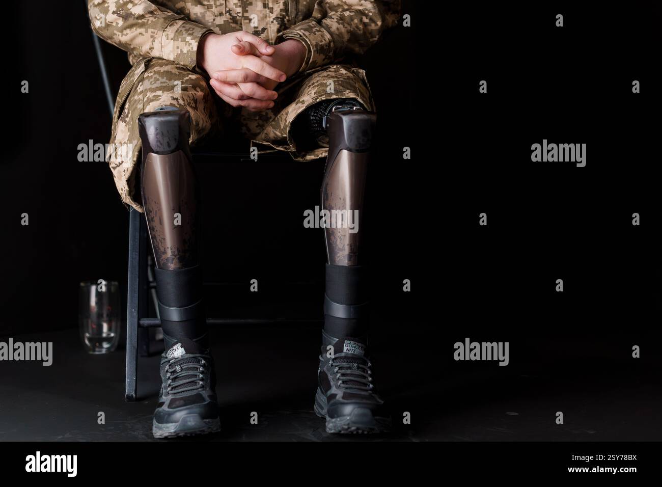 Veteran Seated with Advanced Bionic Leg Prosthesis in Military ...