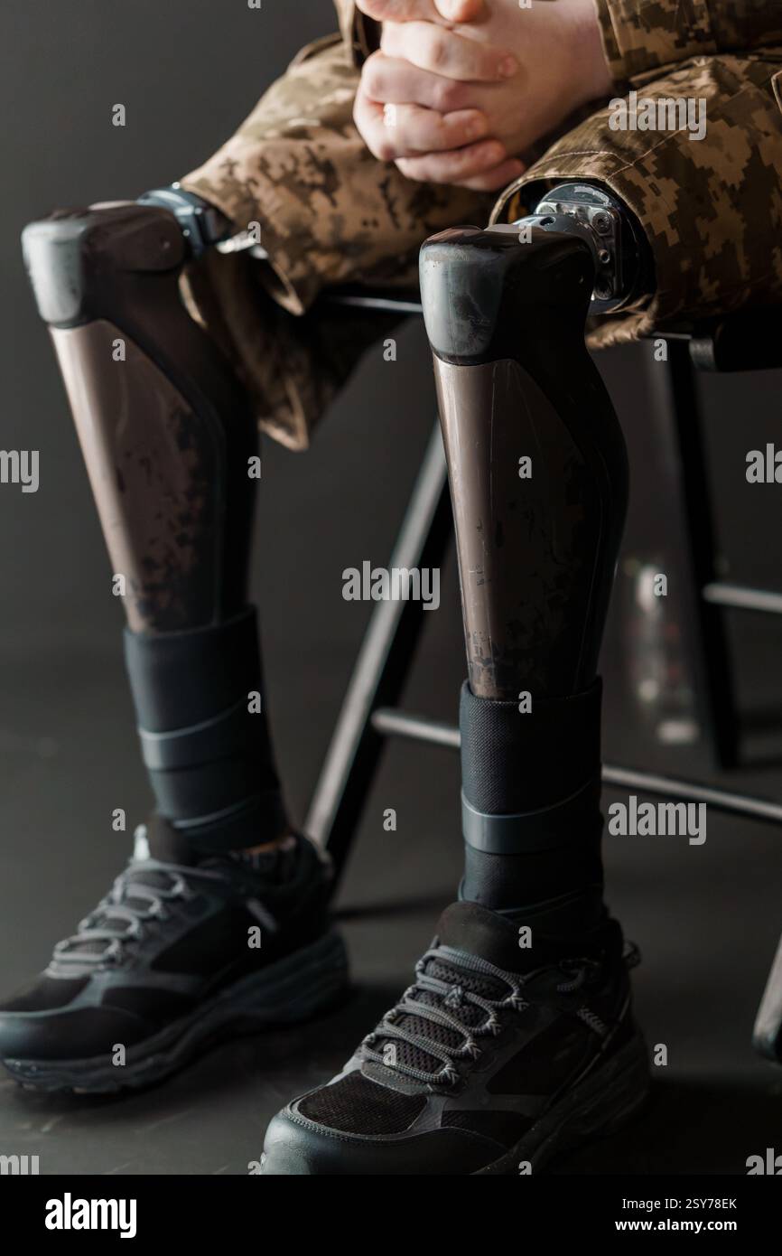 A Close-Up of a Soldier Wearing Advanced Bionic Leg Prosthesis Stock ...