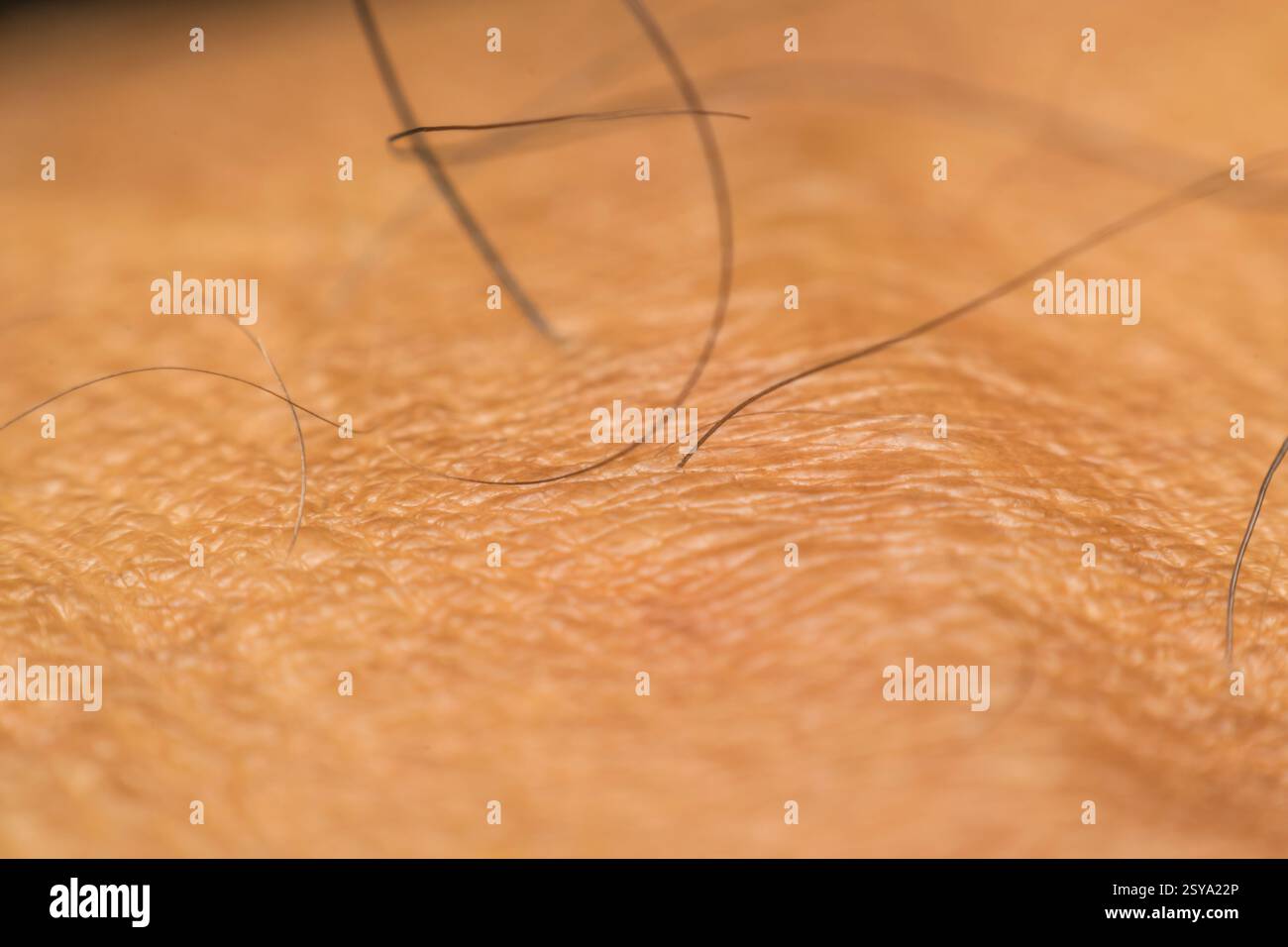 Macro of dry skin asian human with black hairy and pores on wrinkles ...