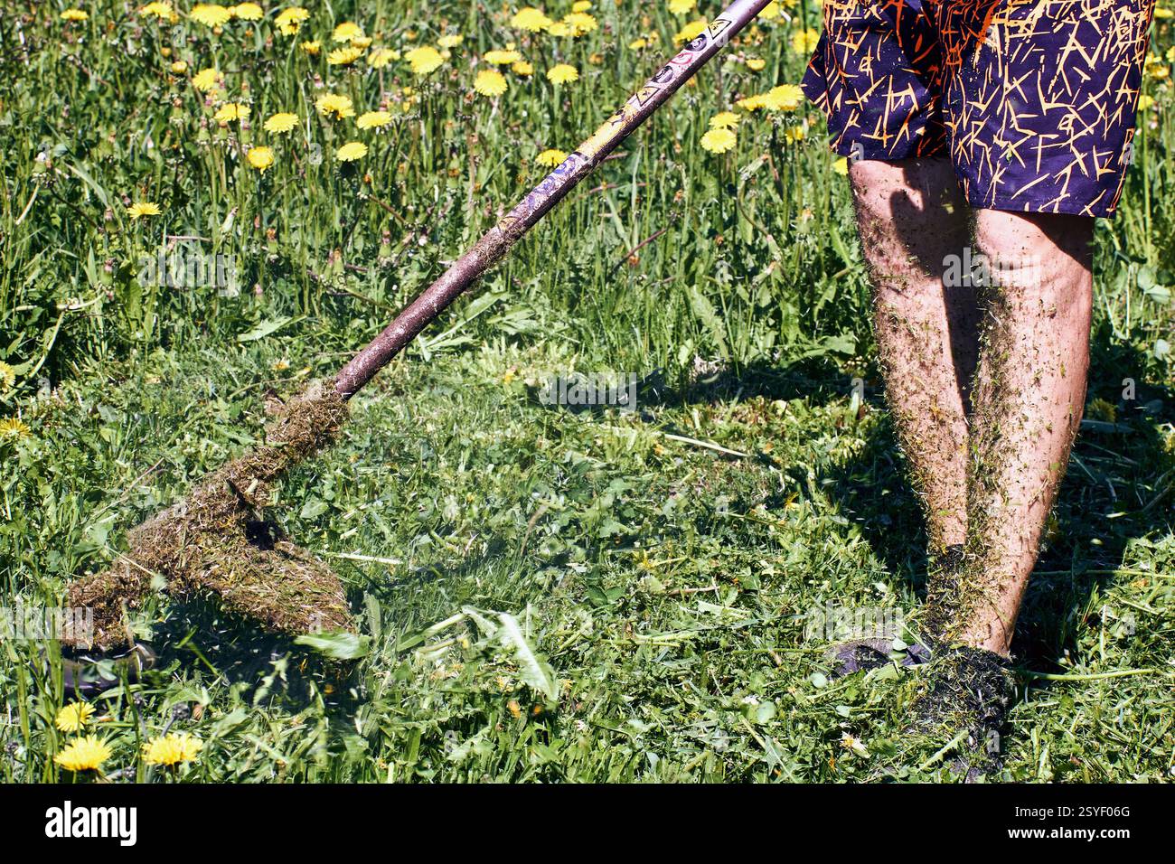 Using line weed trimmer without protective clothing resulted in skin on ...