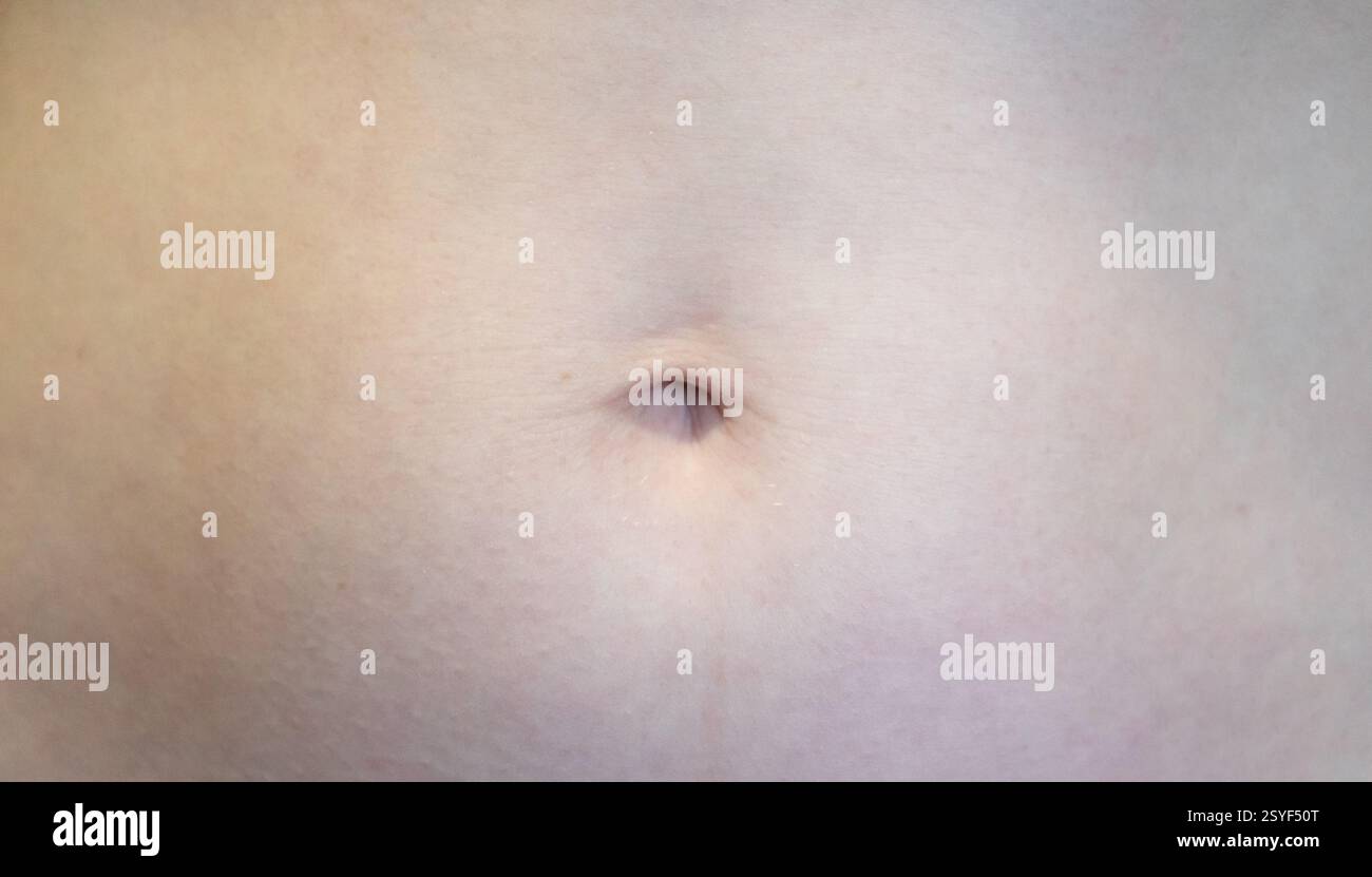 This close-up shows a human abdomen with focus on the navel and skin ...