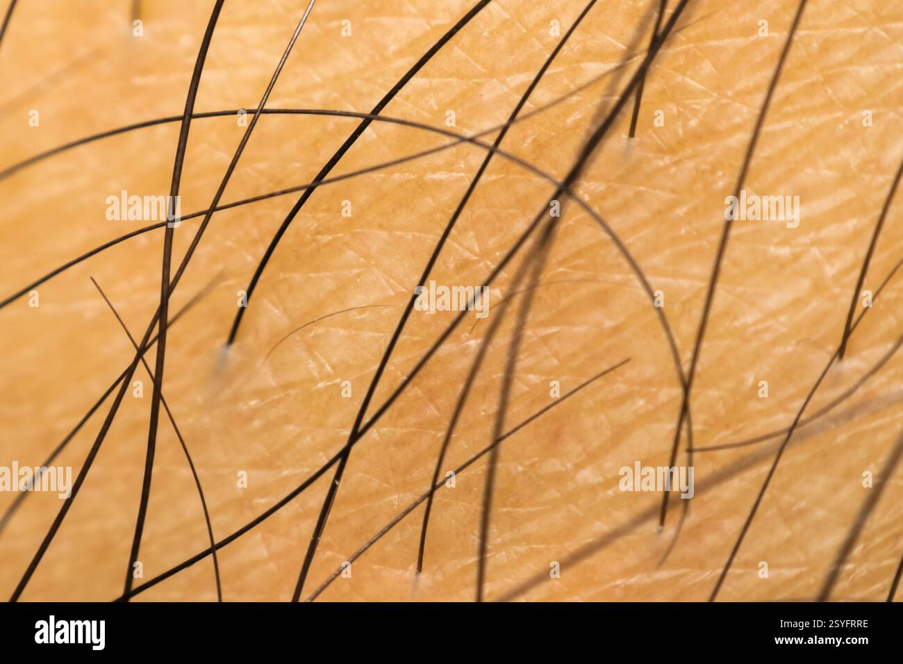 Macro of dry skin asian human with black hairy and pores on wrinkles ...