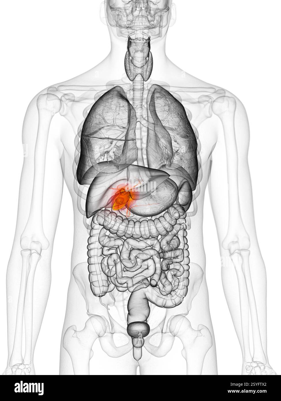 Gallbladder cancer, illustration Stock Photo - Alamy