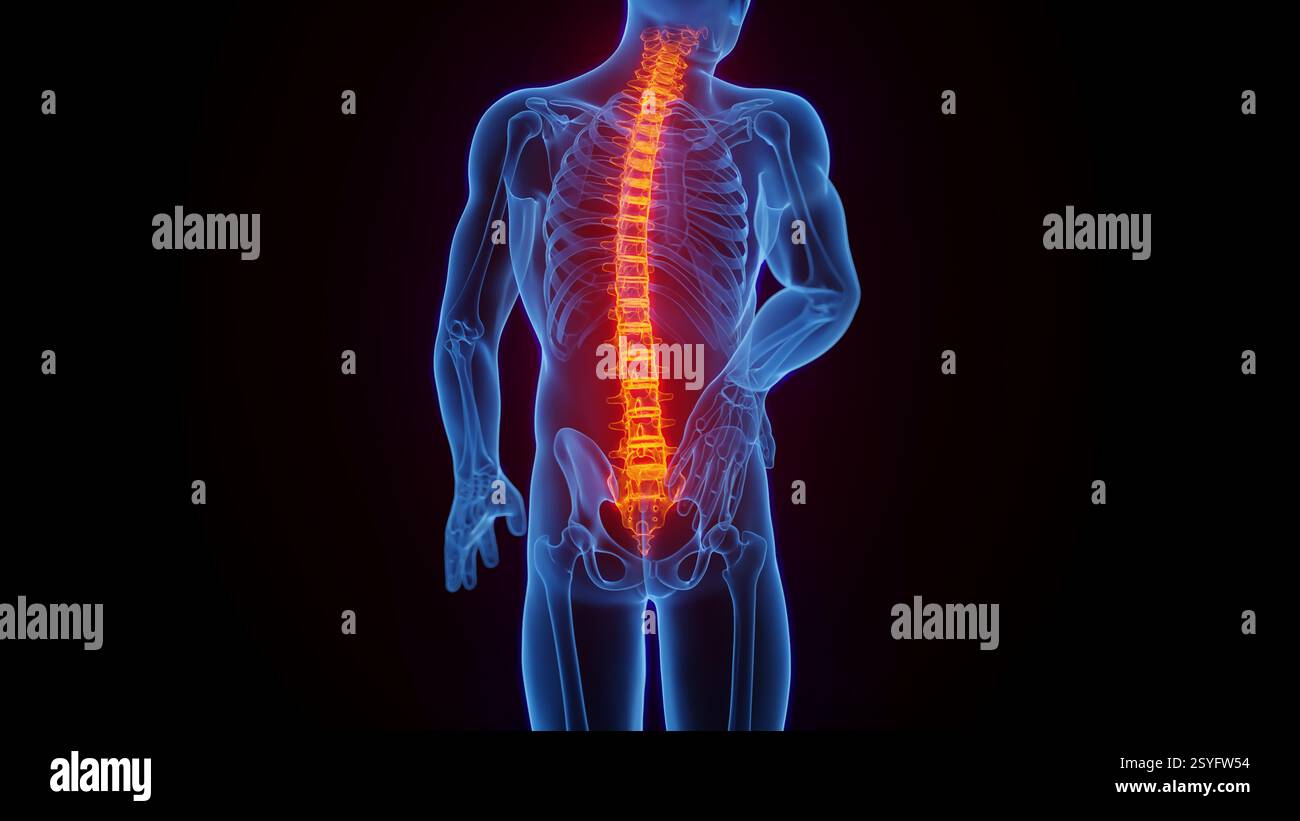 Back pain, illustration Stock Photo - Alamy