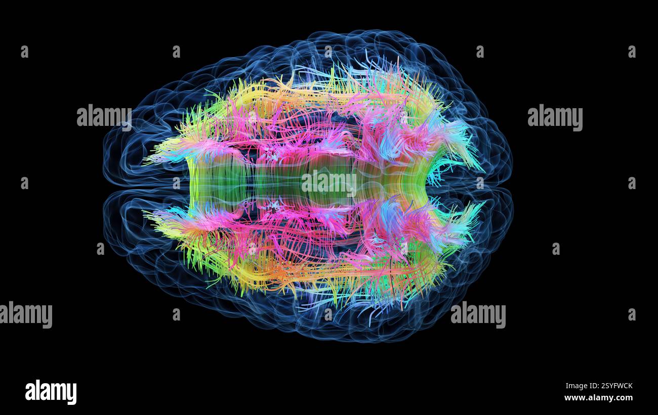 Brain white matter fibres, illustration Stock Photo - Alamy