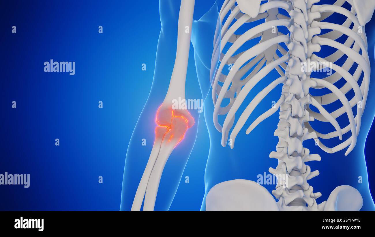 Male elbow joint, illustration Stock Photo - Alamy