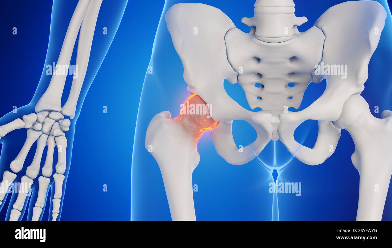 Male hip joint, illustration Stock Photo - Alamy