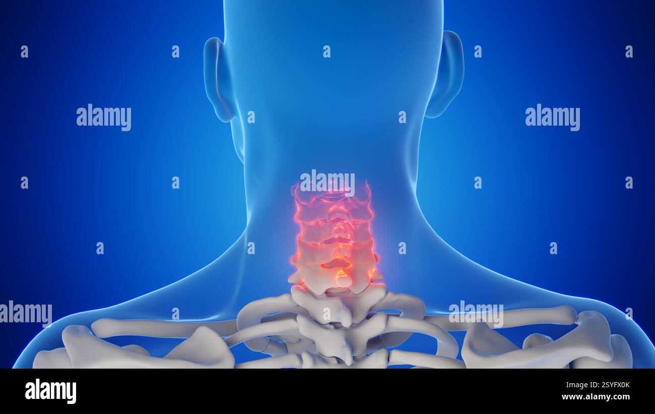 Cervical vertebral column hi-res stock photography and images - Alamy