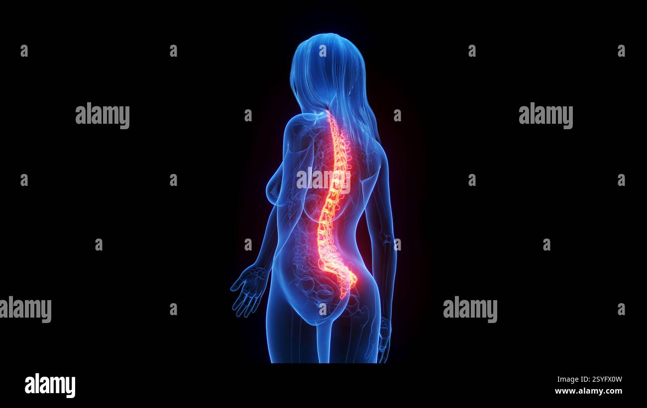 Posterior spine female hi-res stock photography and images - Alamy