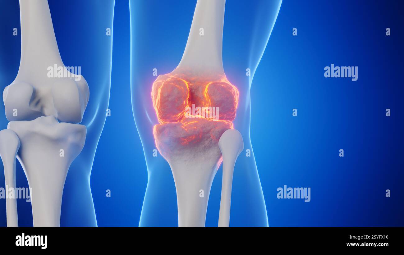 Male knee, illustration Stock Photo - Alamy