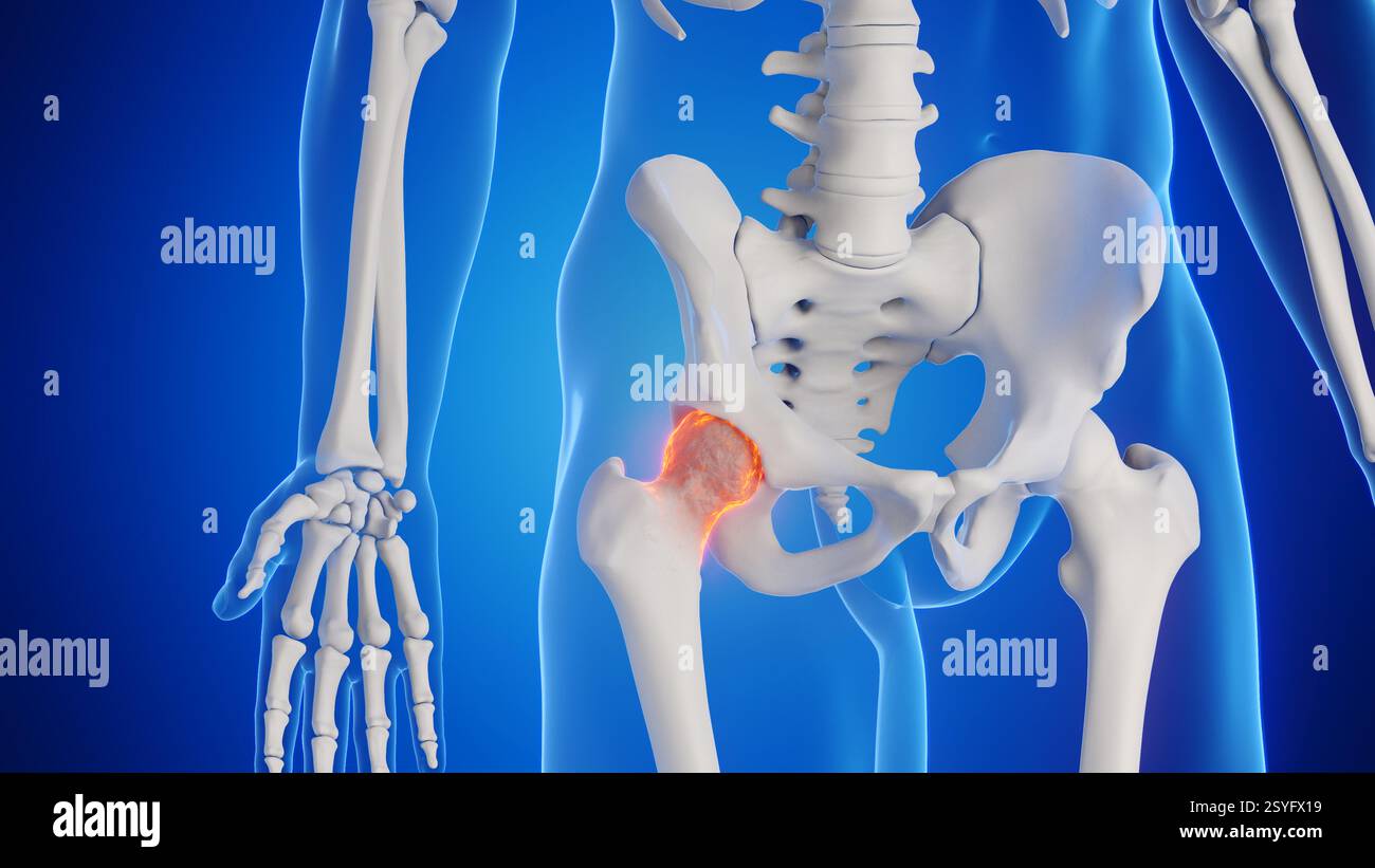 Lateral rotation of hip joint hi-res stock photography and images - Alamy