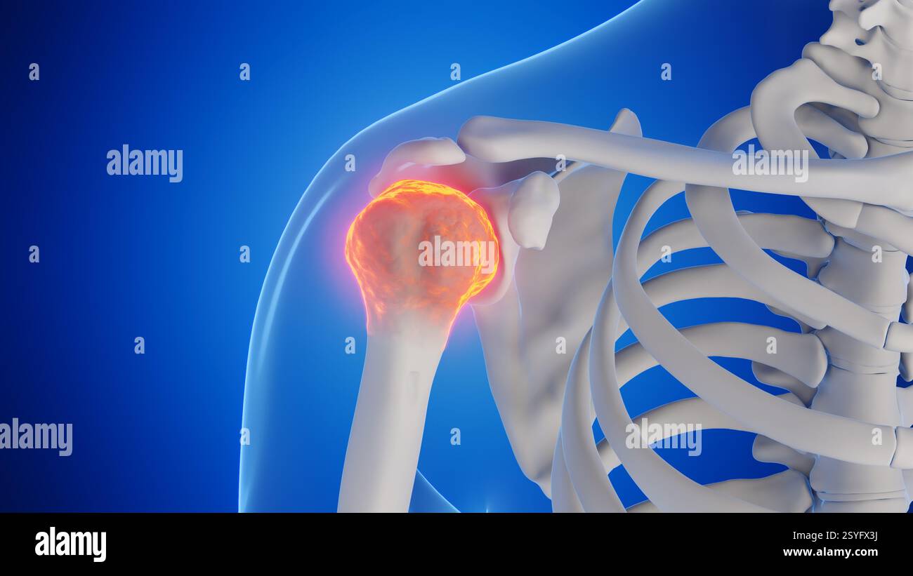 Male shoulder joint, illustration Stock Photo - Alamy
