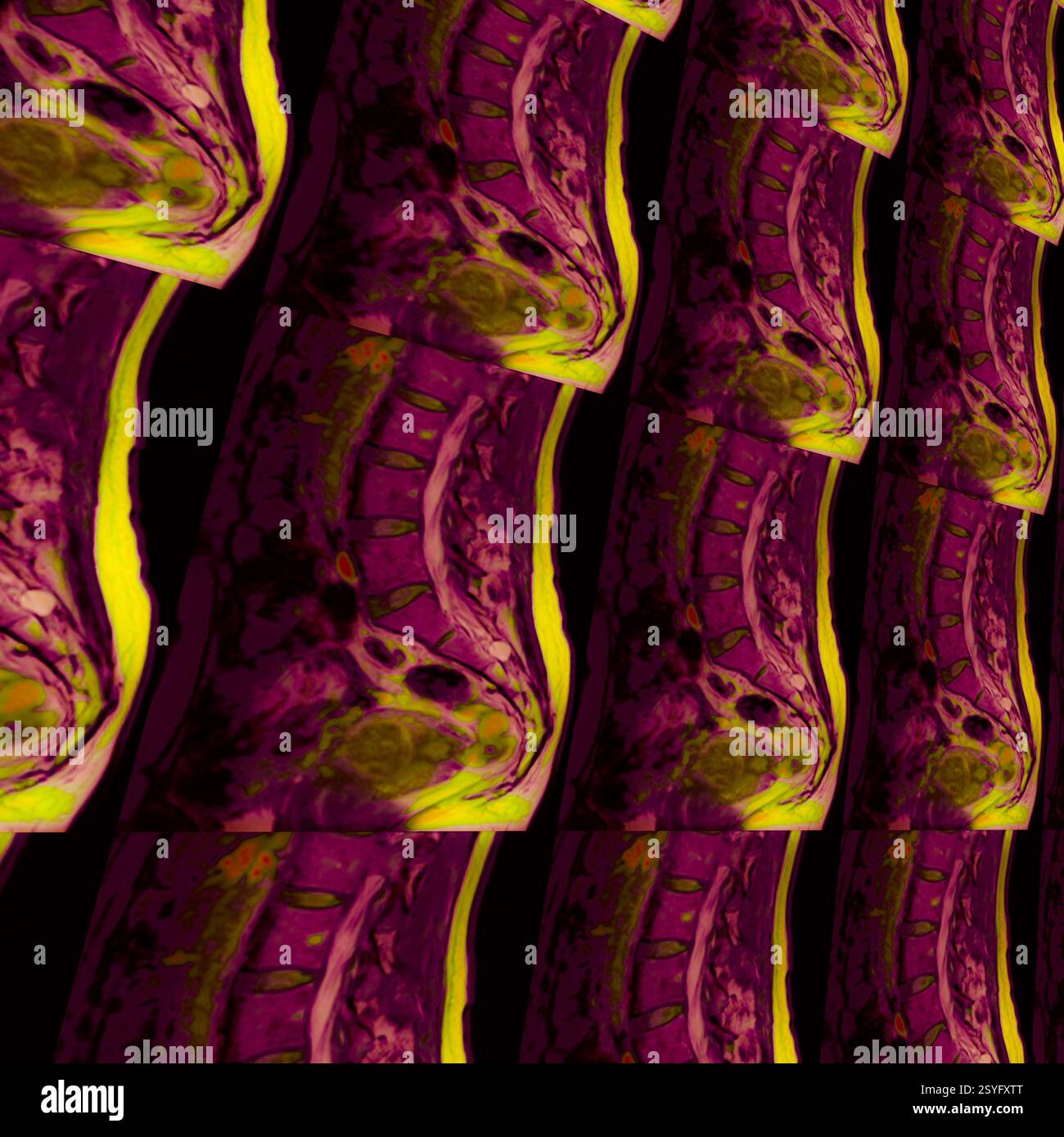 Sagittal coloured magnetic resonance imaging (MRI) scans of a healthy ...