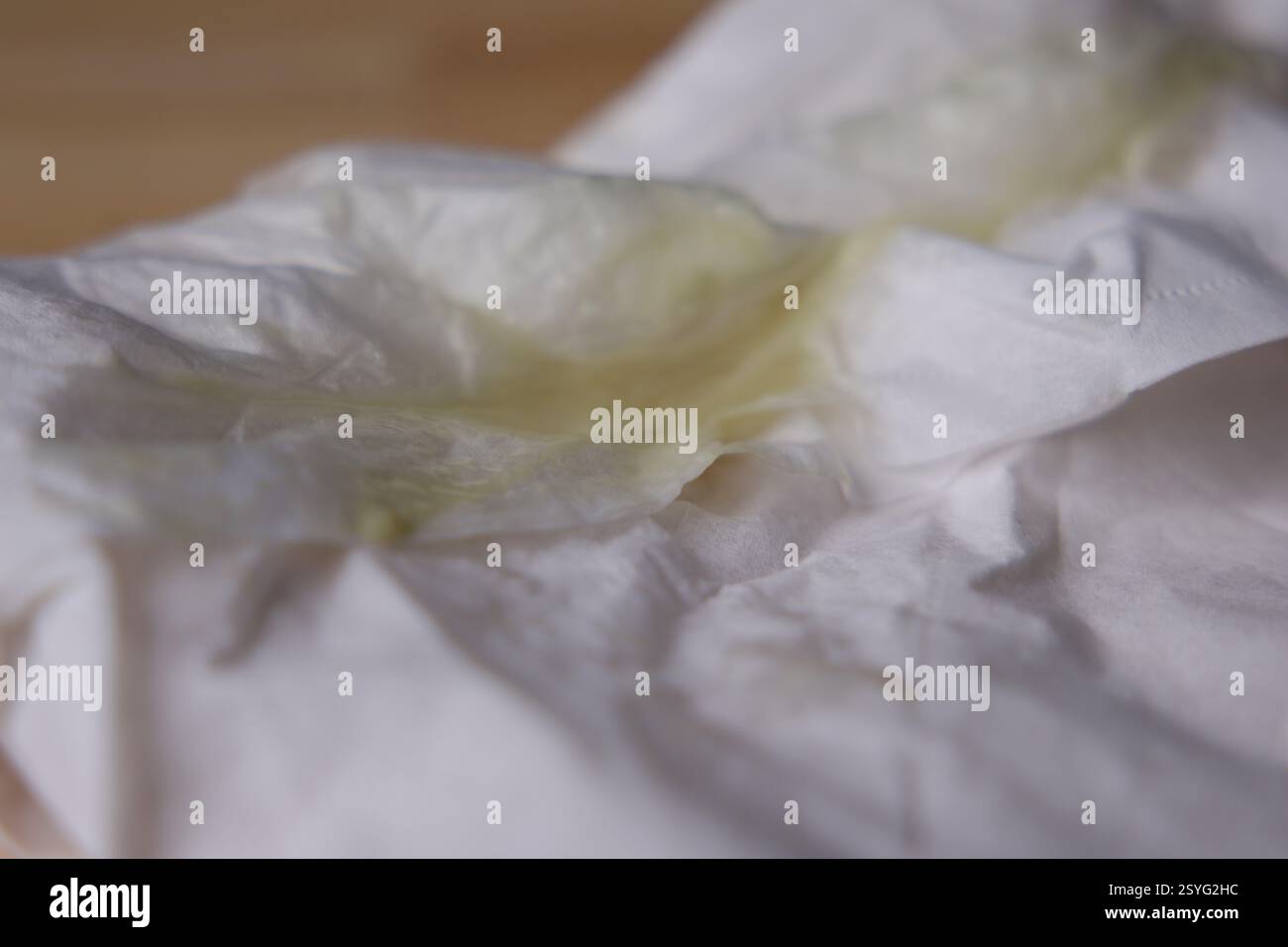 Health concept nasal congestion and mucus Stock Photo - Alamy