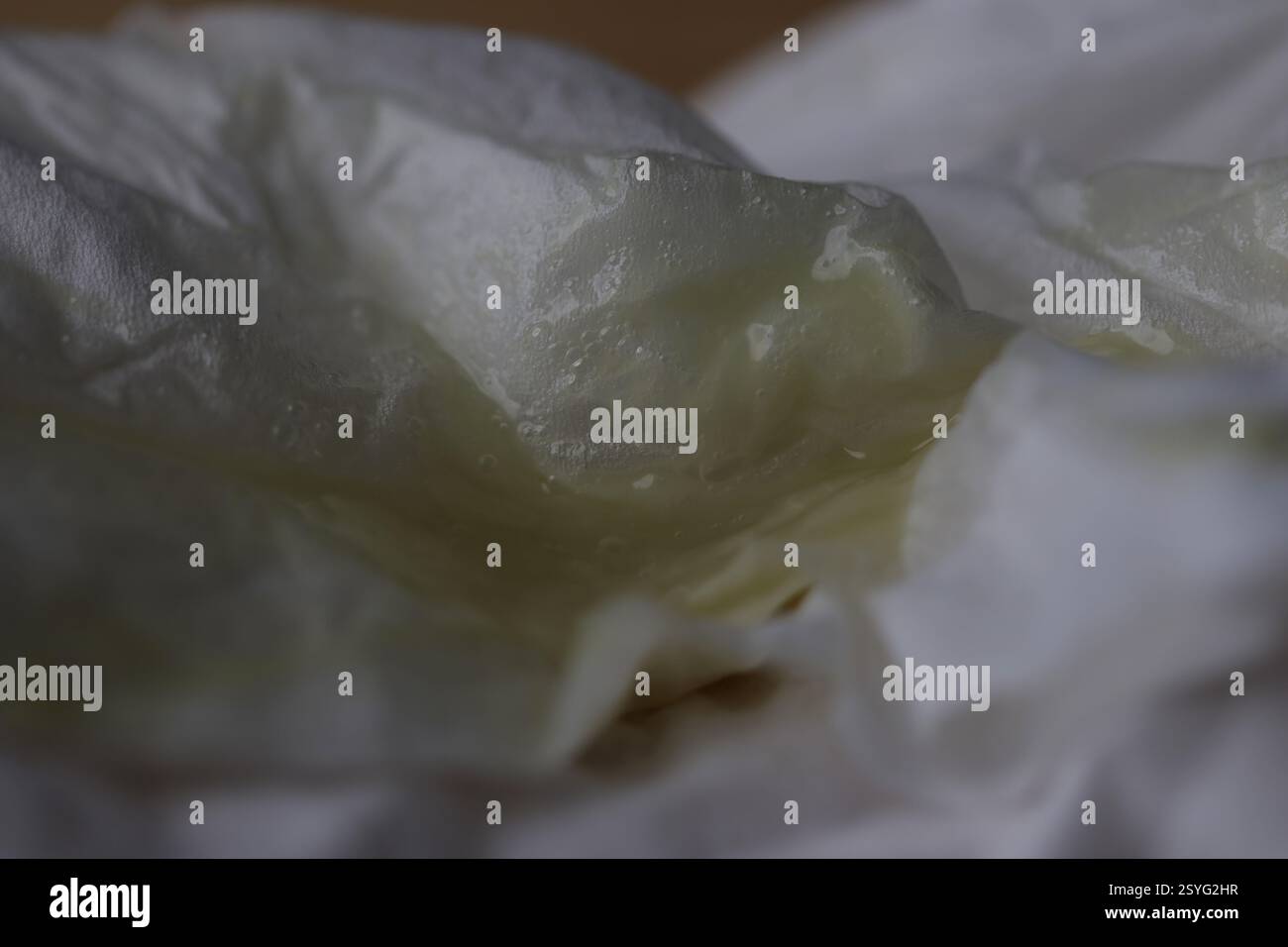 Mucus congestion phlegm yellow and green mucus Stock Photo - Alamy