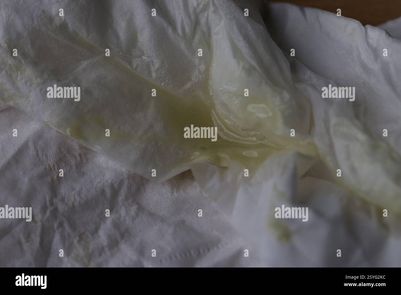 Mucus phlegm from illness. Health and wellness Stock Photo - Alamy