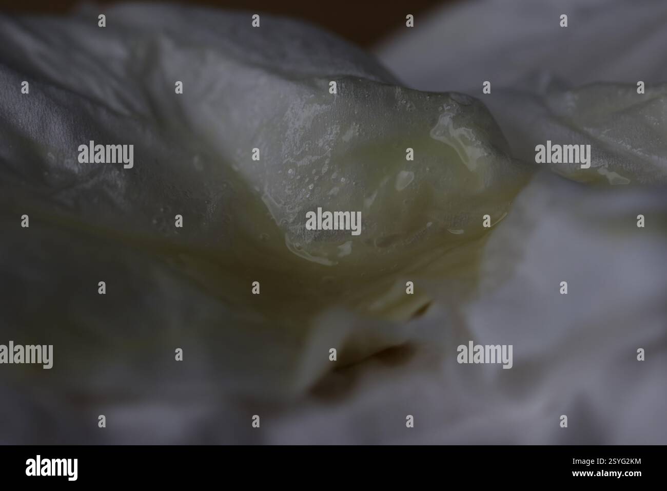 Phlegm close up mucus in napkin Stock Photo - Alamy