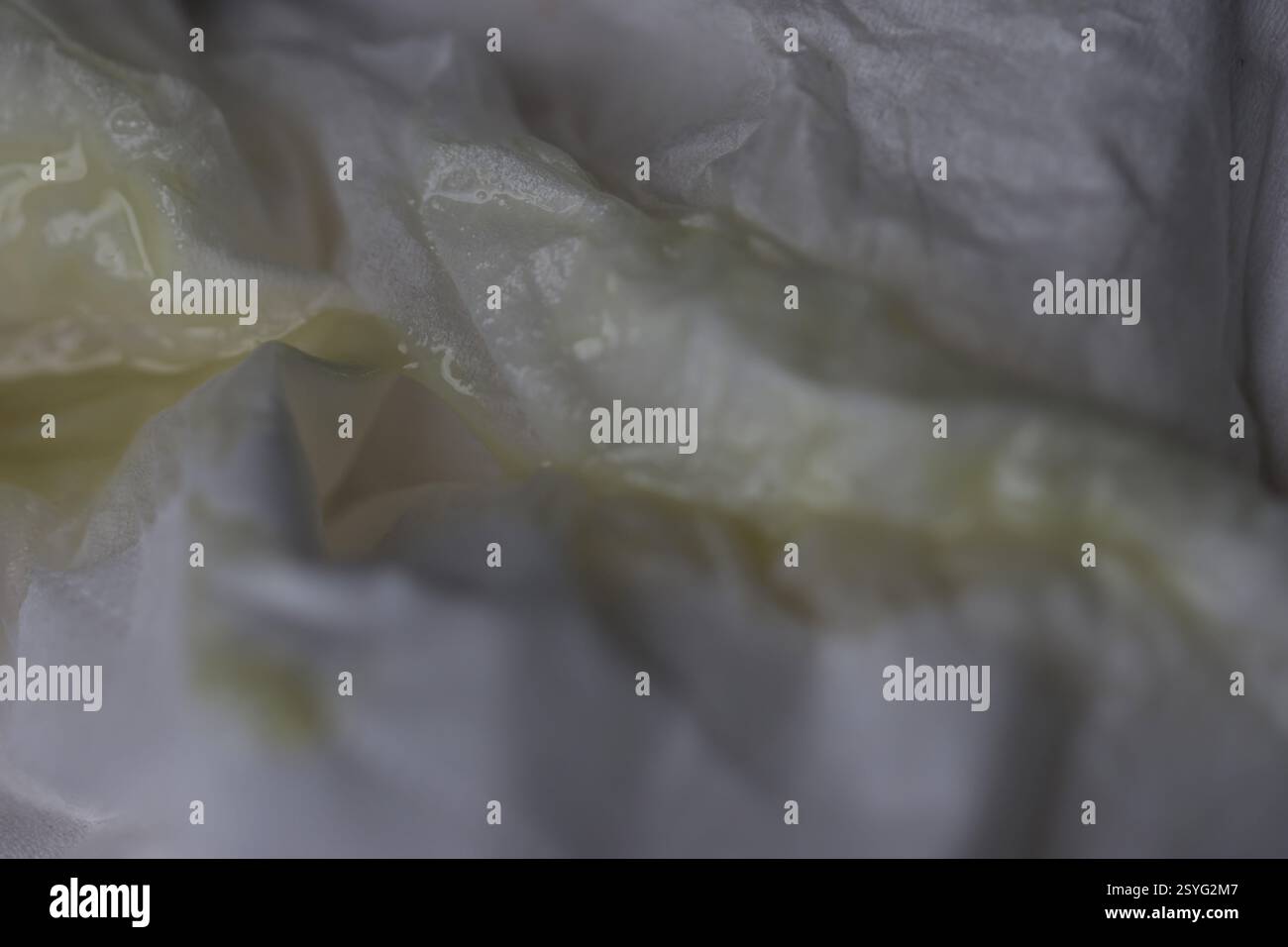 Yellow fever patient hi-res stock photography and images - Alamy