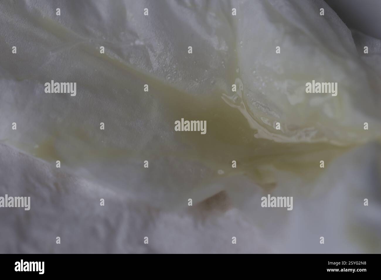 Phlegm macro close up mucus in napkin. Sick and rundown with a cold ...