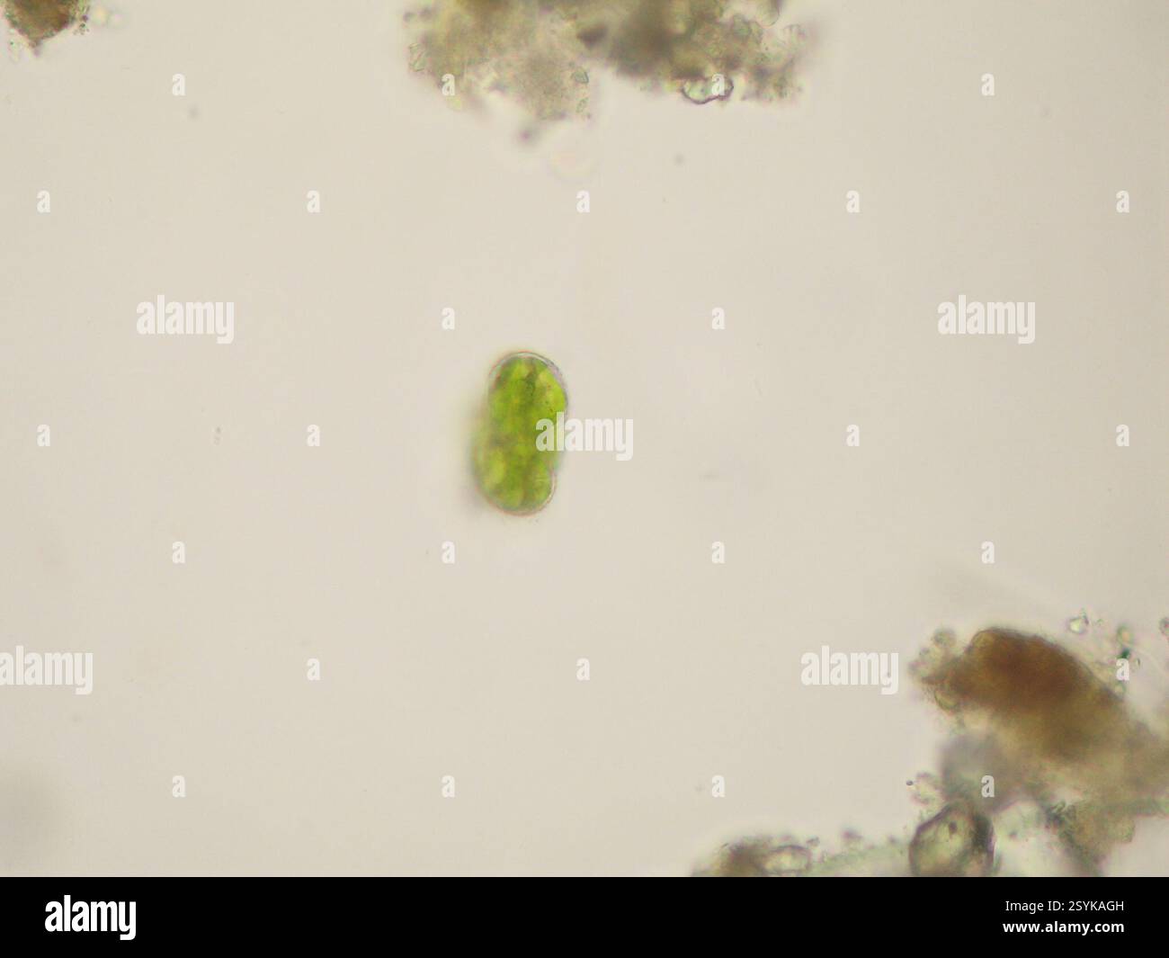 (Cosmarium vexatum rotundatum), Plantae, Forest Park Southeast, St ...