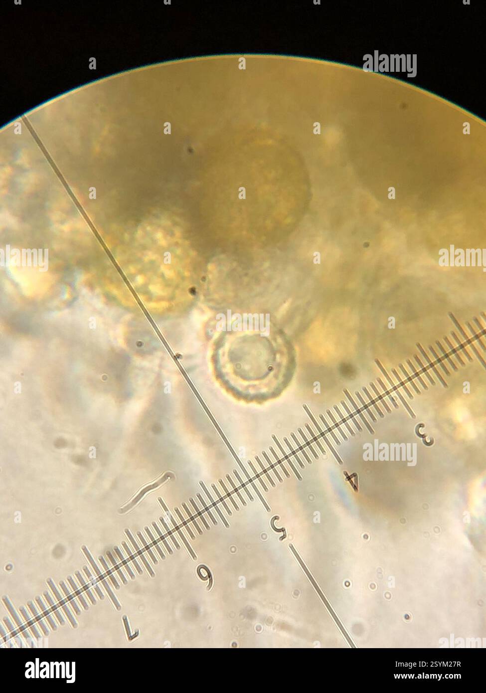 (Sepedonium ampullosporum), Fungi, Church Ave, Saanich, BC, CA, see ...