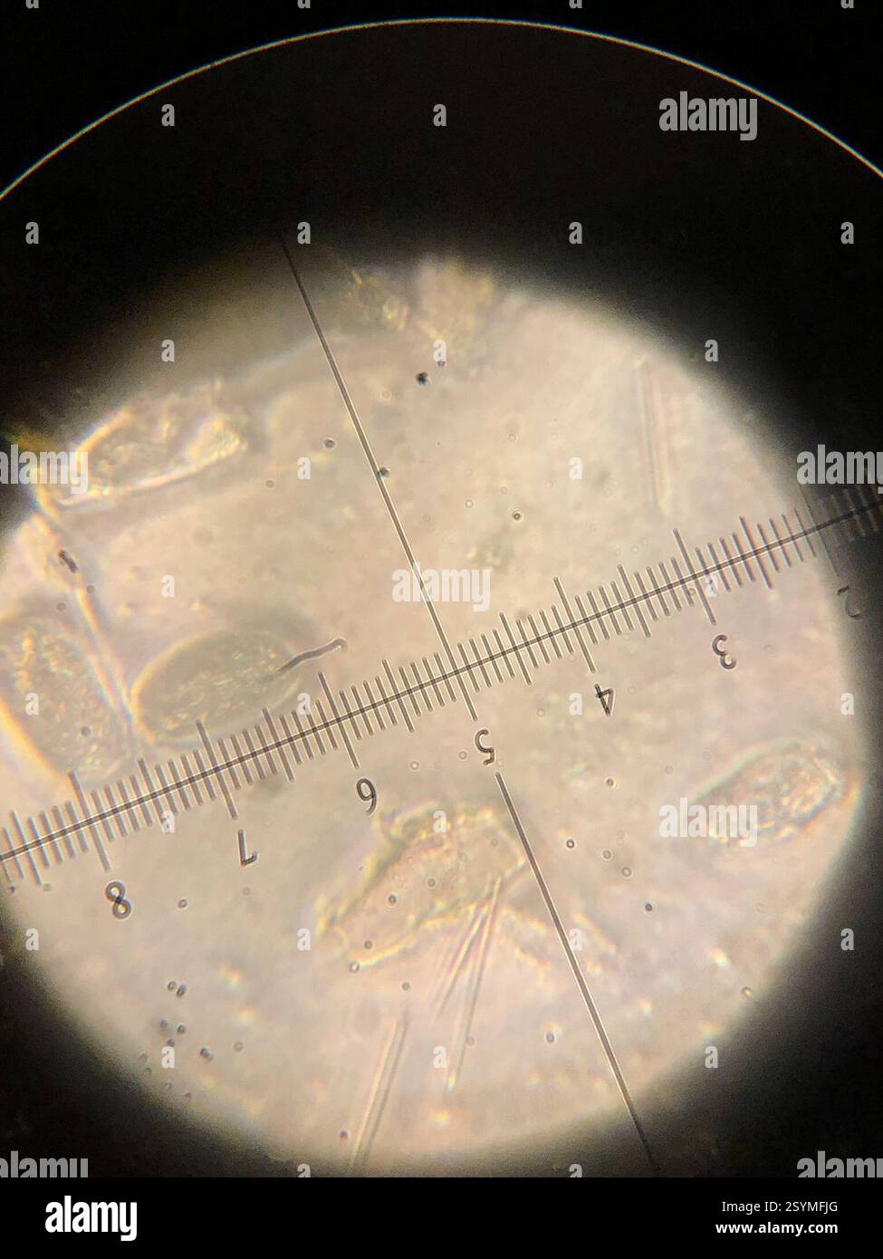 Grape Erineum Mite (Colomerus vitis), Arachnida, Cedar Hill Rd, Saanich ...