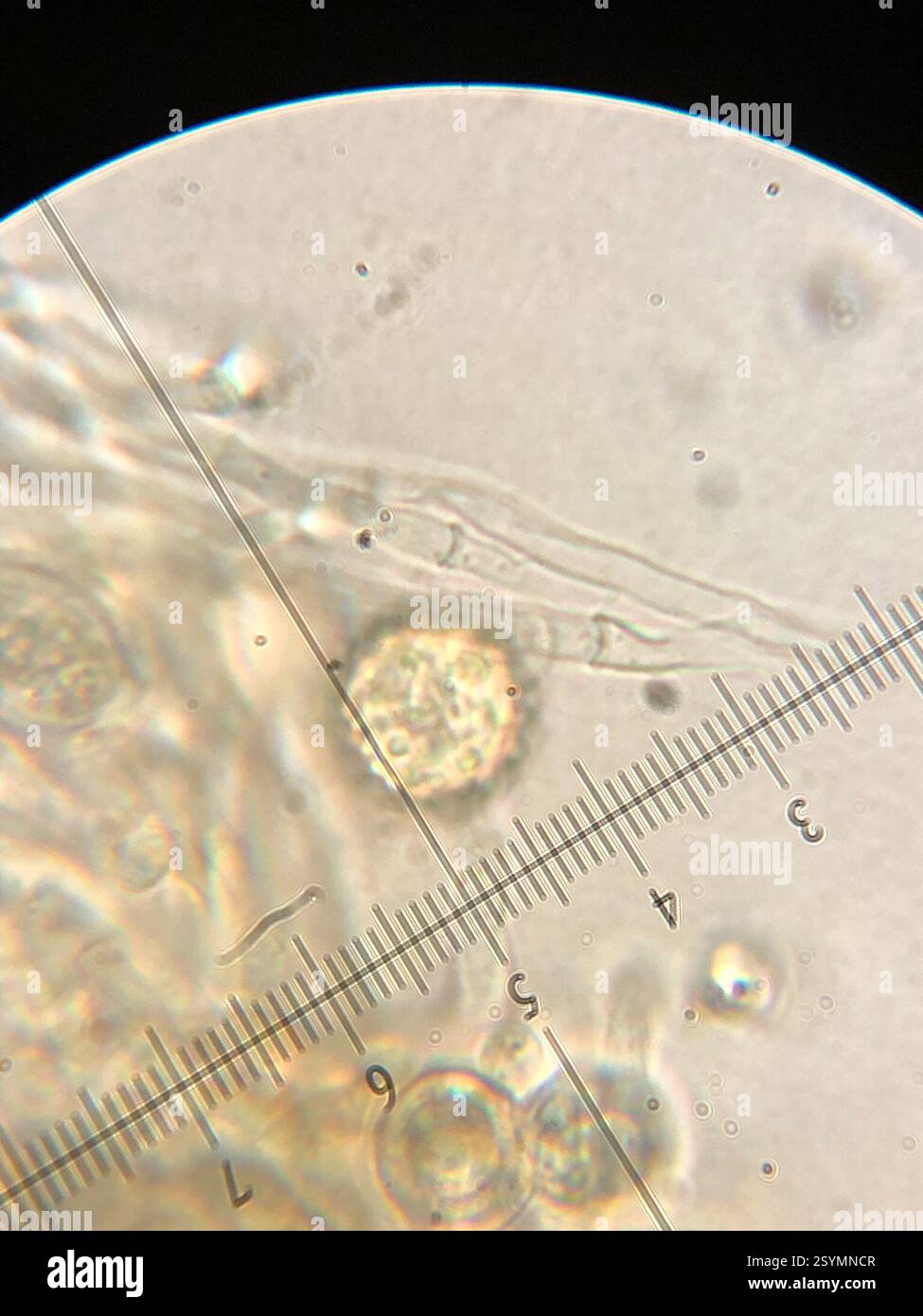 (Sepedonium ampullosporum), Fungi, Church Ave, Saanich, BC, CA, see ...