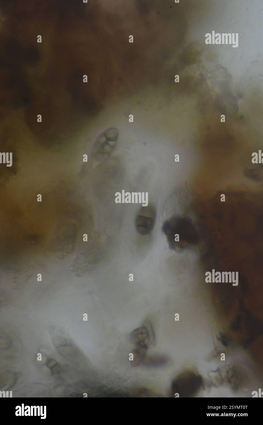 (Pleostigma jungermannicola), Fungi, Whistler, BC V8E, Canada, Best ...