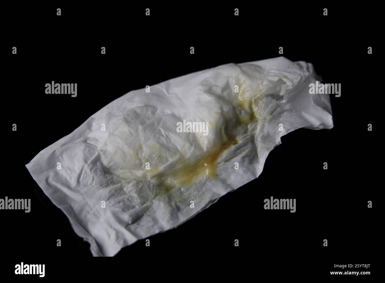 Coughing congestion chest inflammation phlegm Stock Photo - Alamy