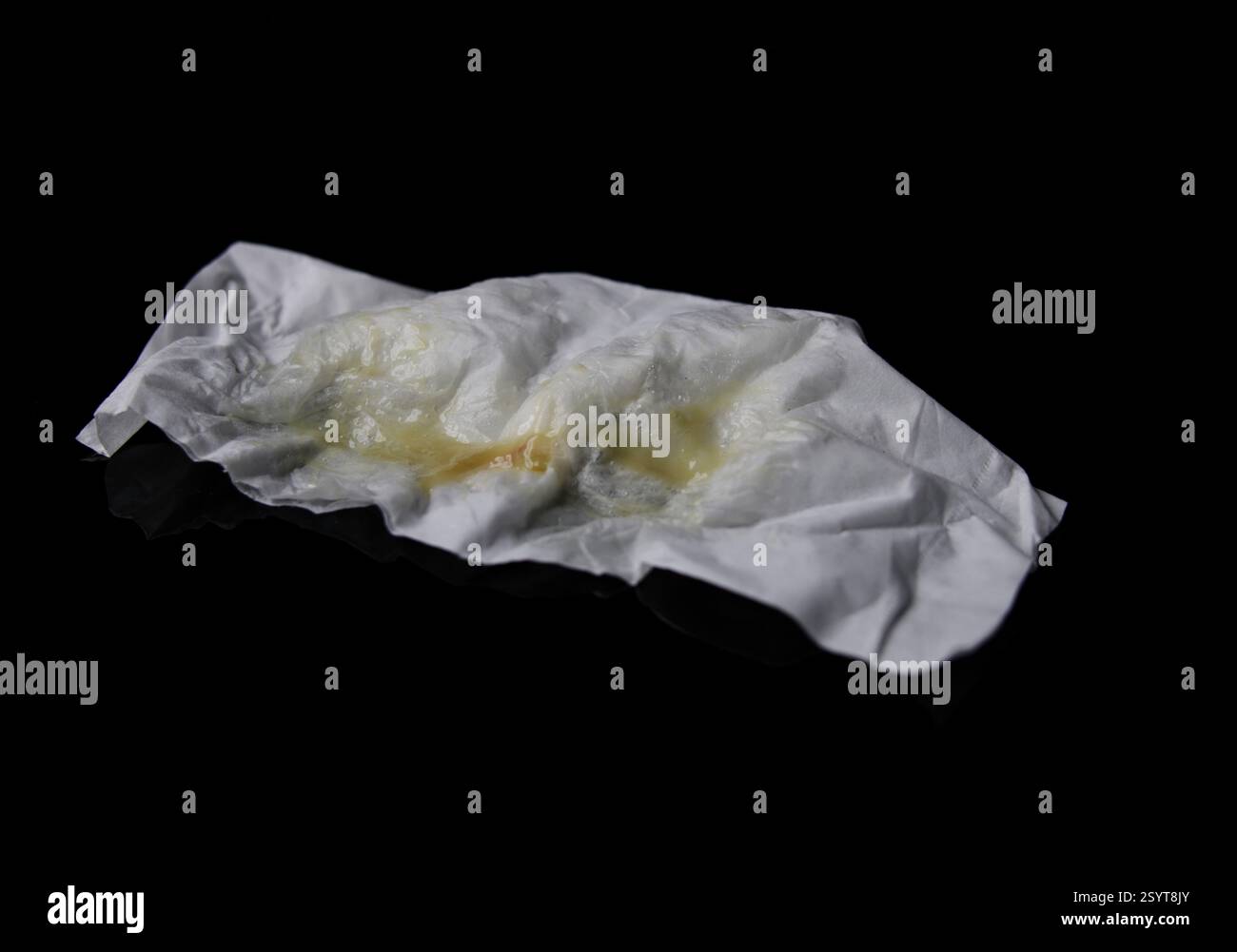 Mucus phlegm close up sickness and disease Stock Photo - Alamy