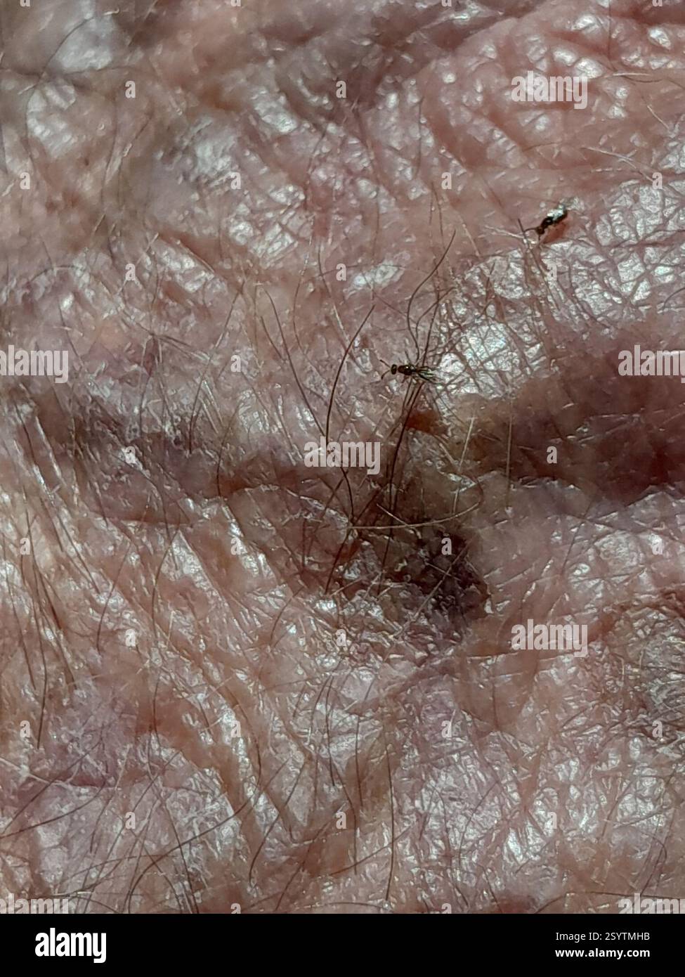 Chalcidoid Wasps (Chalcidoidea), Insecta, Edgemead, Cape Town, 7407 ...