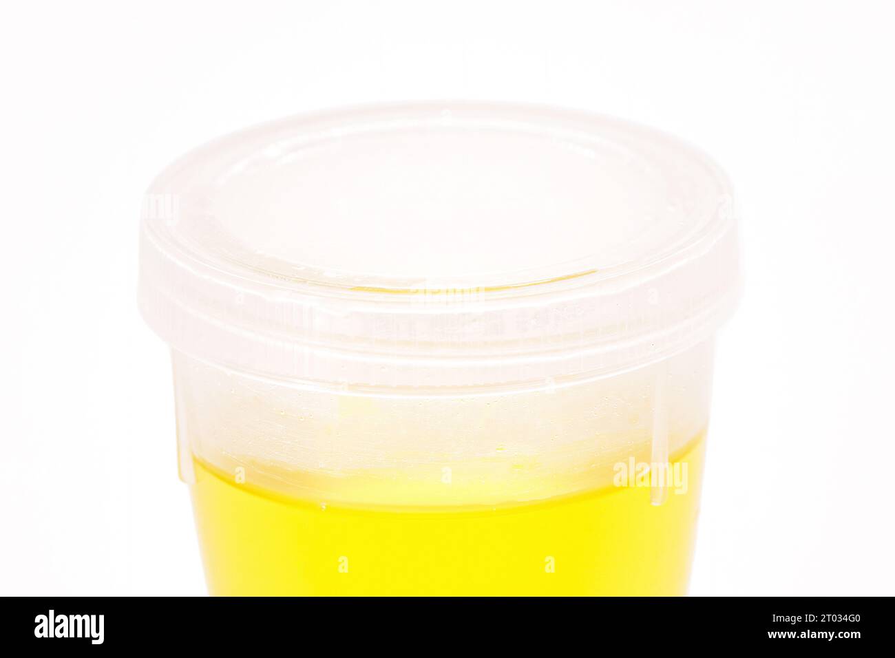 urine for examination collected in disposable plastic bottle ...