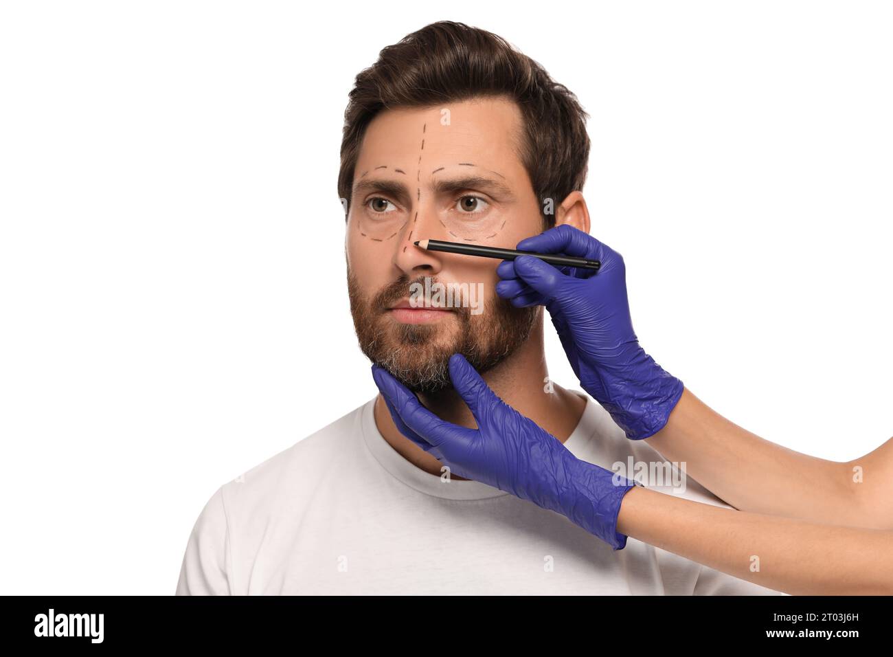 Doctor with pencil preparing patient for cosmetic surgery operation on ...
