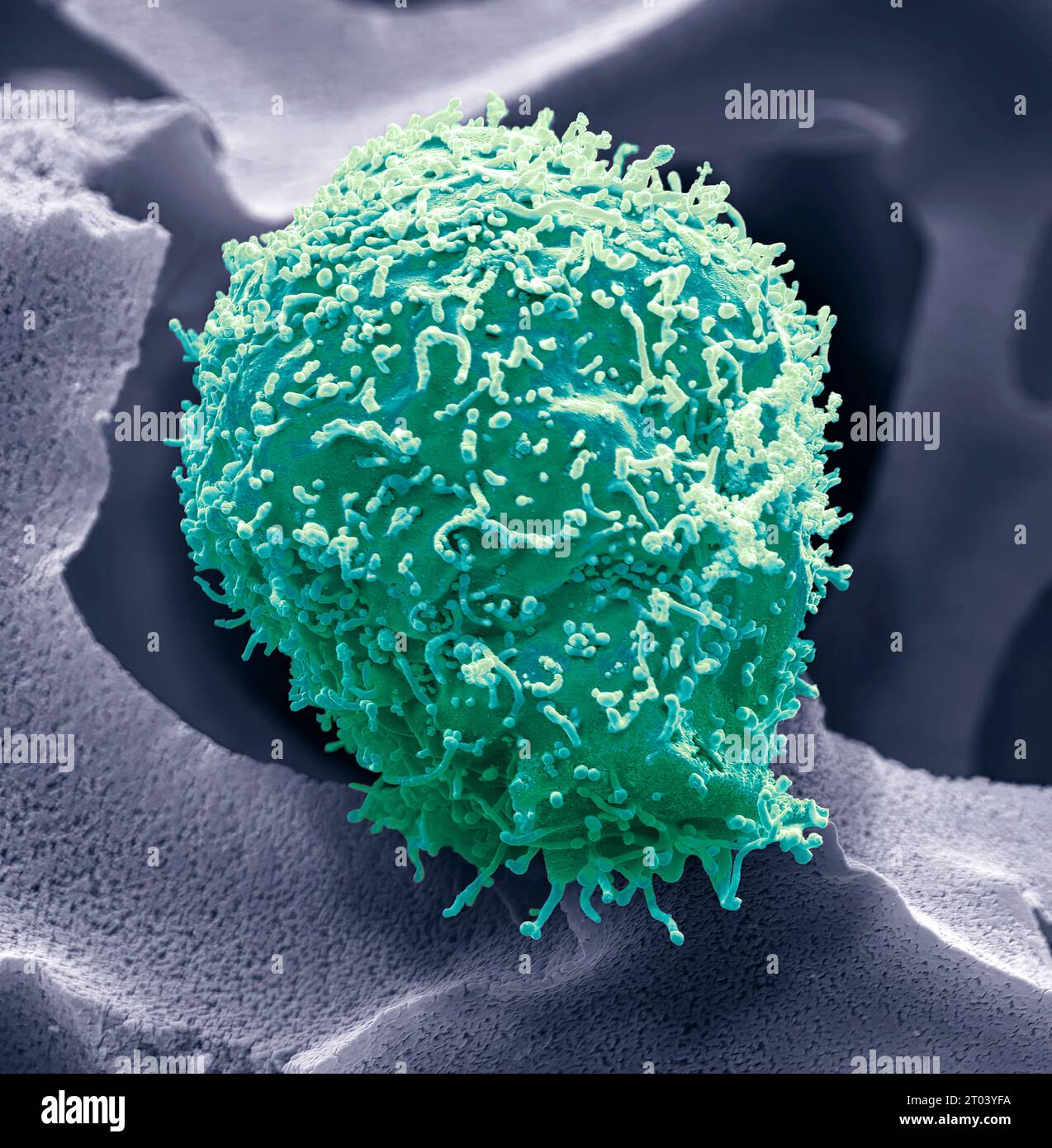 HeLa cell. Coloured scanning electron micrograph (SEM) of a HeLa cell ...