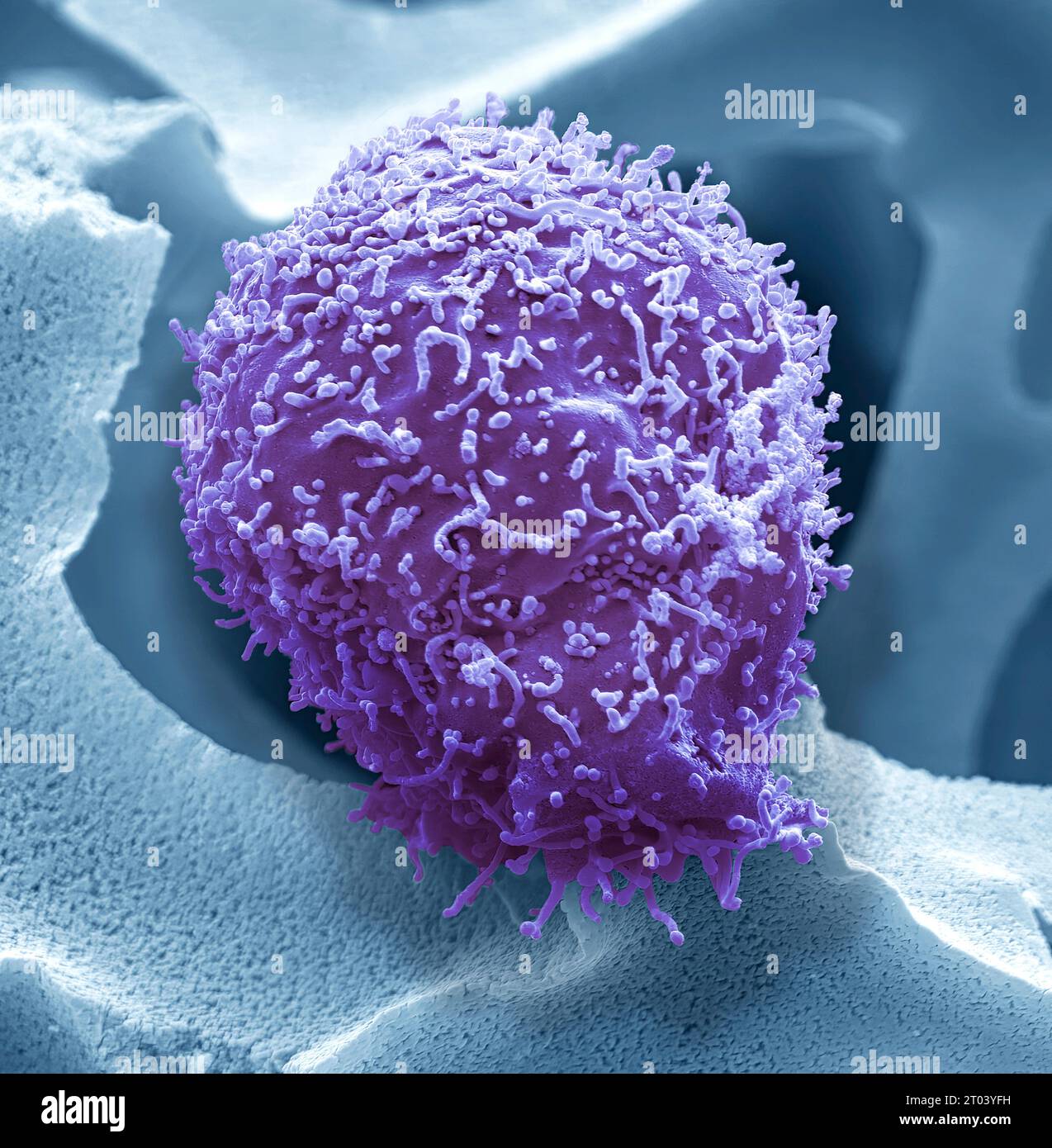 HeLa cell. Coloured scanning electron micrograph (SEM) of a HeLa cell ...