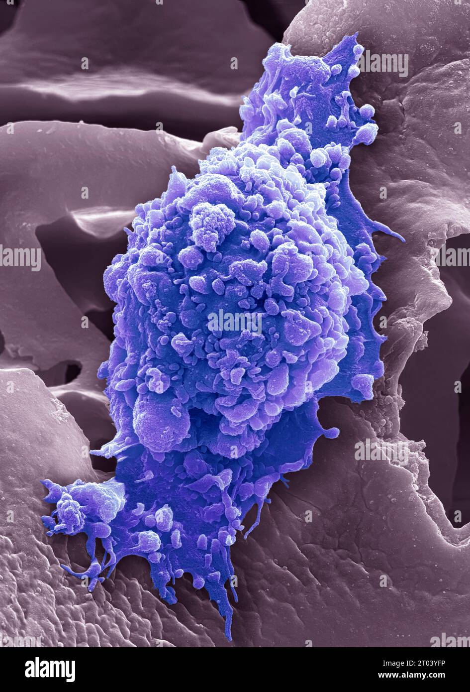 HeLa cell. Coloured scanning electron micrograph (SEM) of a HeLa cell ...
