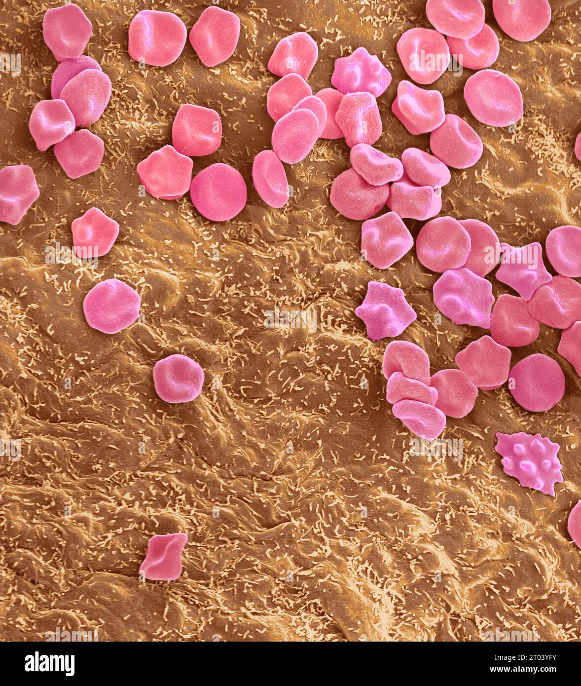 Coloured scanning electron micrograph (SEM) of a fracture through a ...