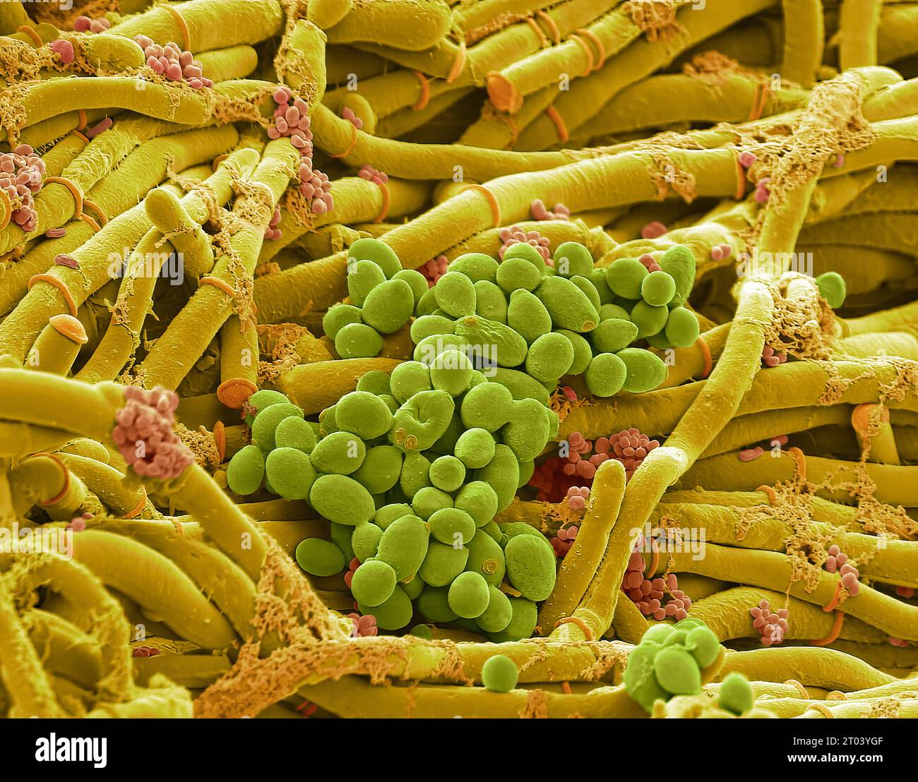 Oral fungi. Coloured scanning electron micrograph (SEM) of a culture ...