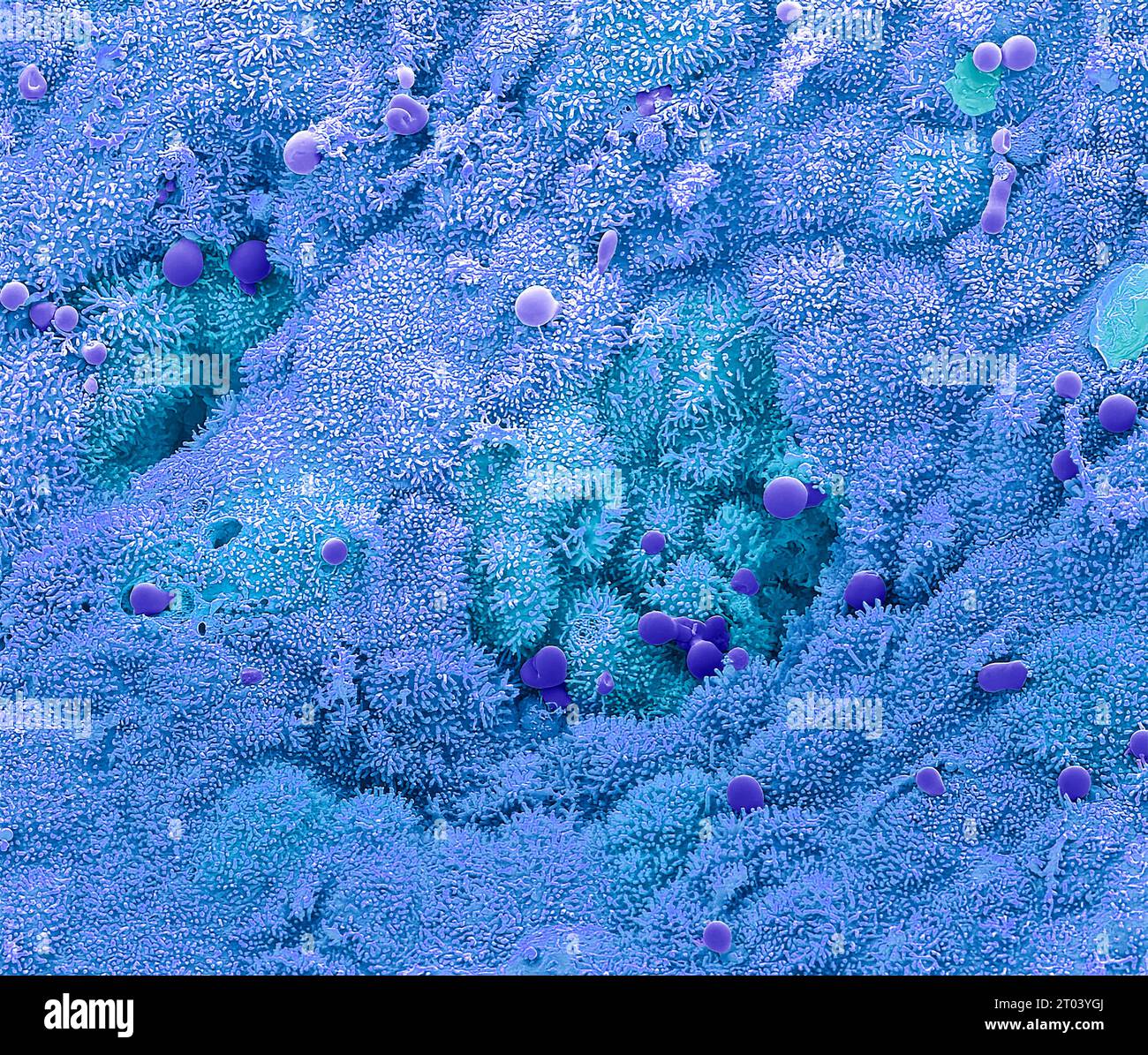 Uterus endometrium. Coloured Scanning Electron Micrograph (SEM ...