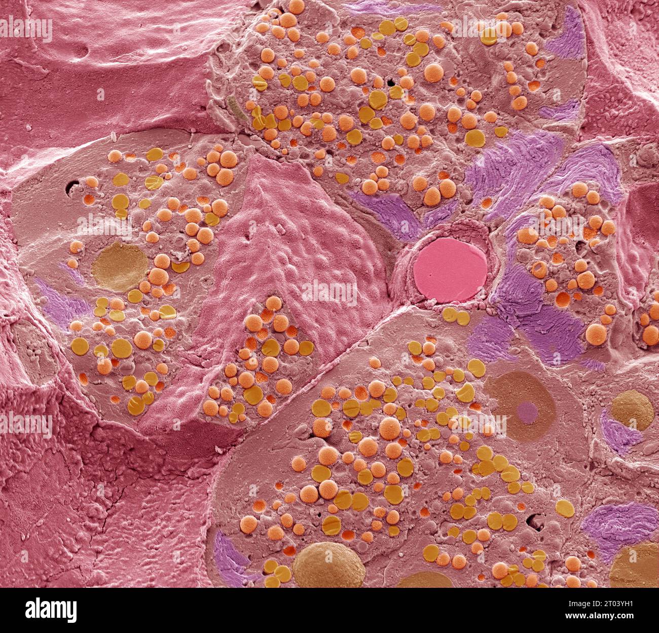 Pancreatic tissue. Scanning electron micrograph (SEM) of a freeze ...
