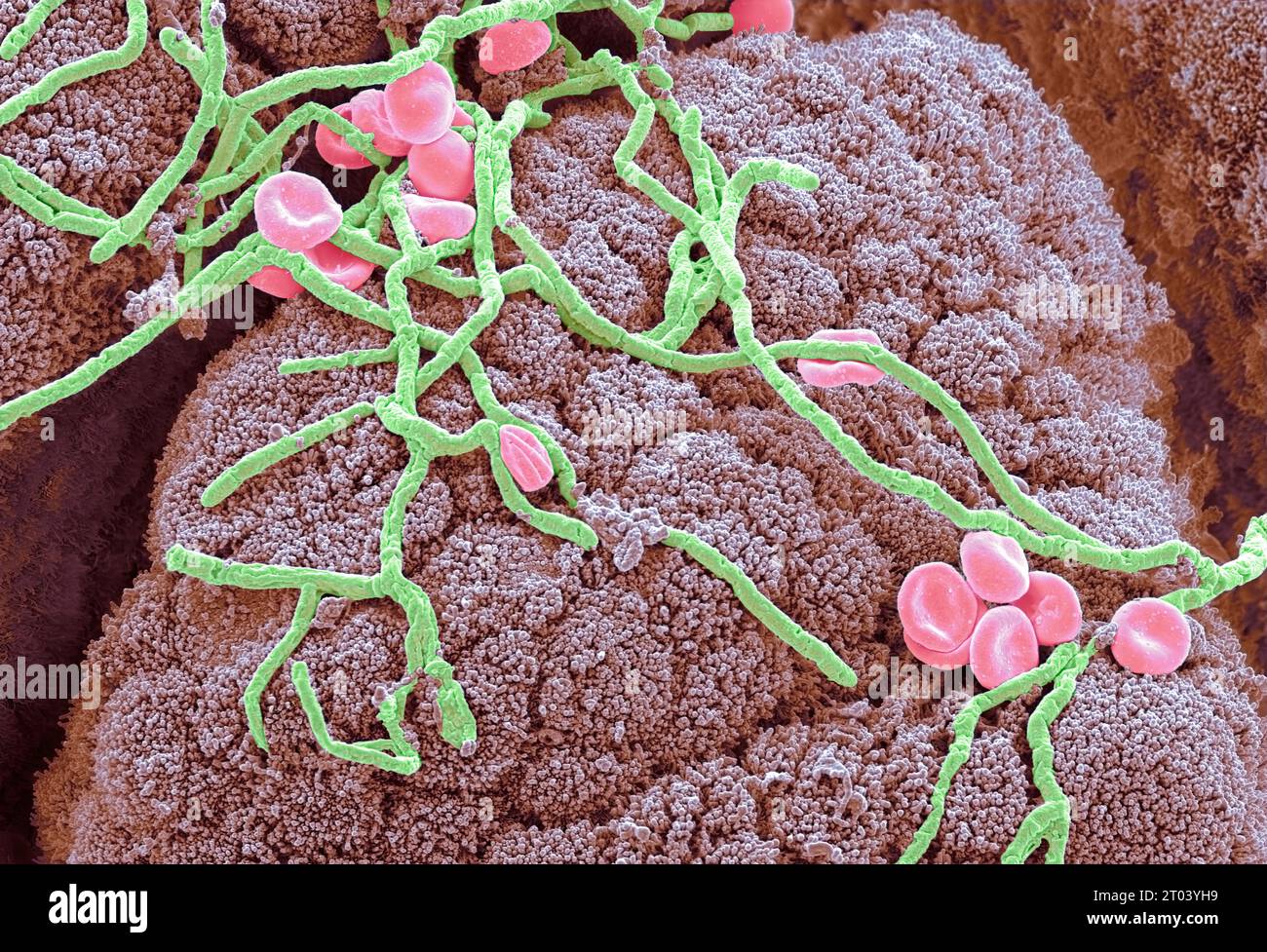 Fungal infection of the gut. Coloured scanning electron micrograph (SEM ...