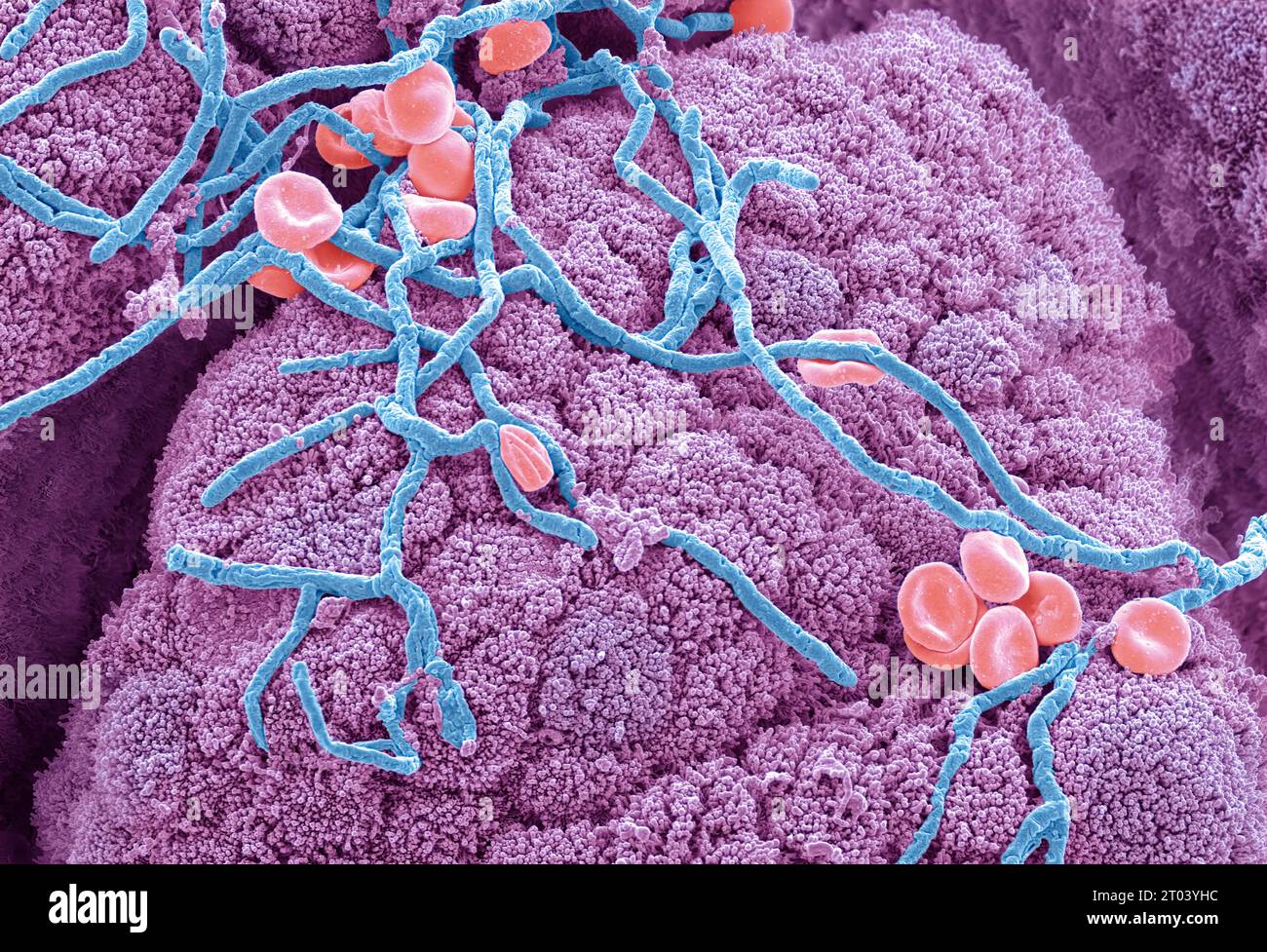Fungal Infection Of The Gut Coloured Scanning Electron Micrograph Sem Magnification X3000