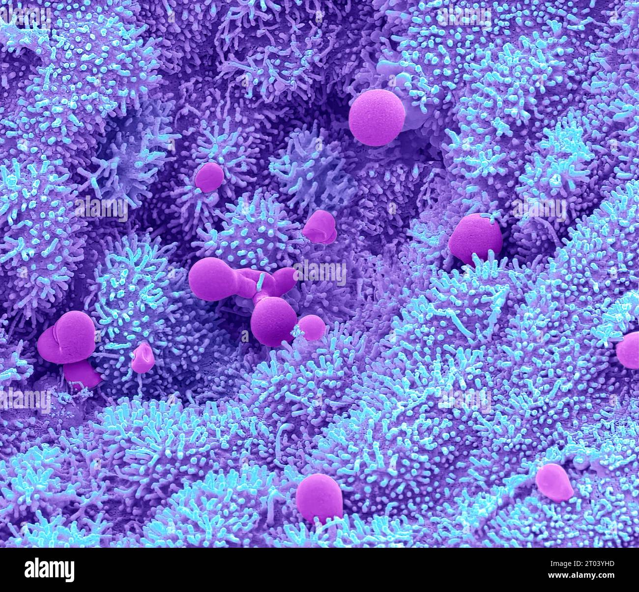 Uterus endometrium. Coloured Scanning Electron Micrograph (SEM ...