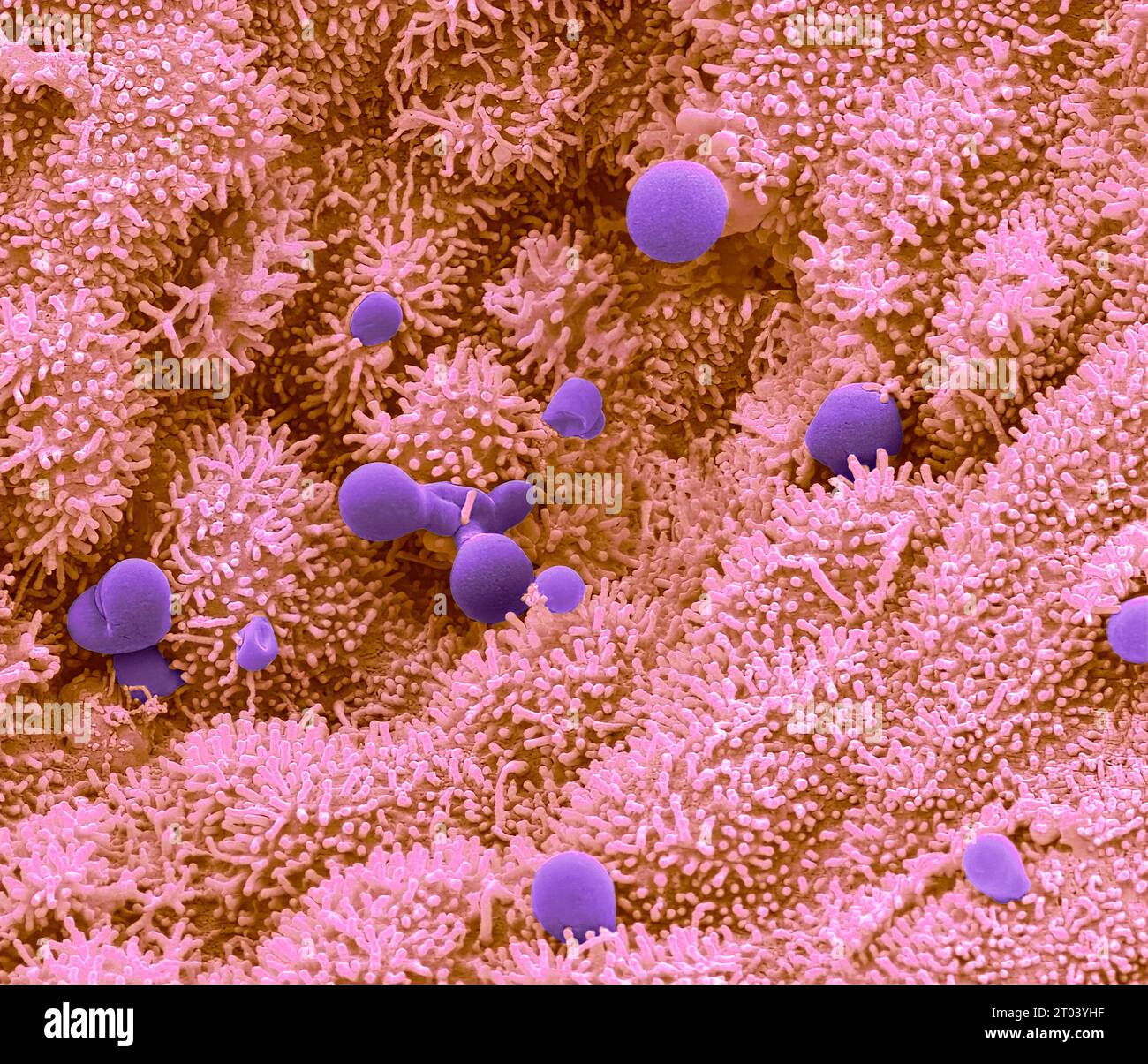 Uterus endometrium. Coloured Scanning Electron Micrograph (SEM ...