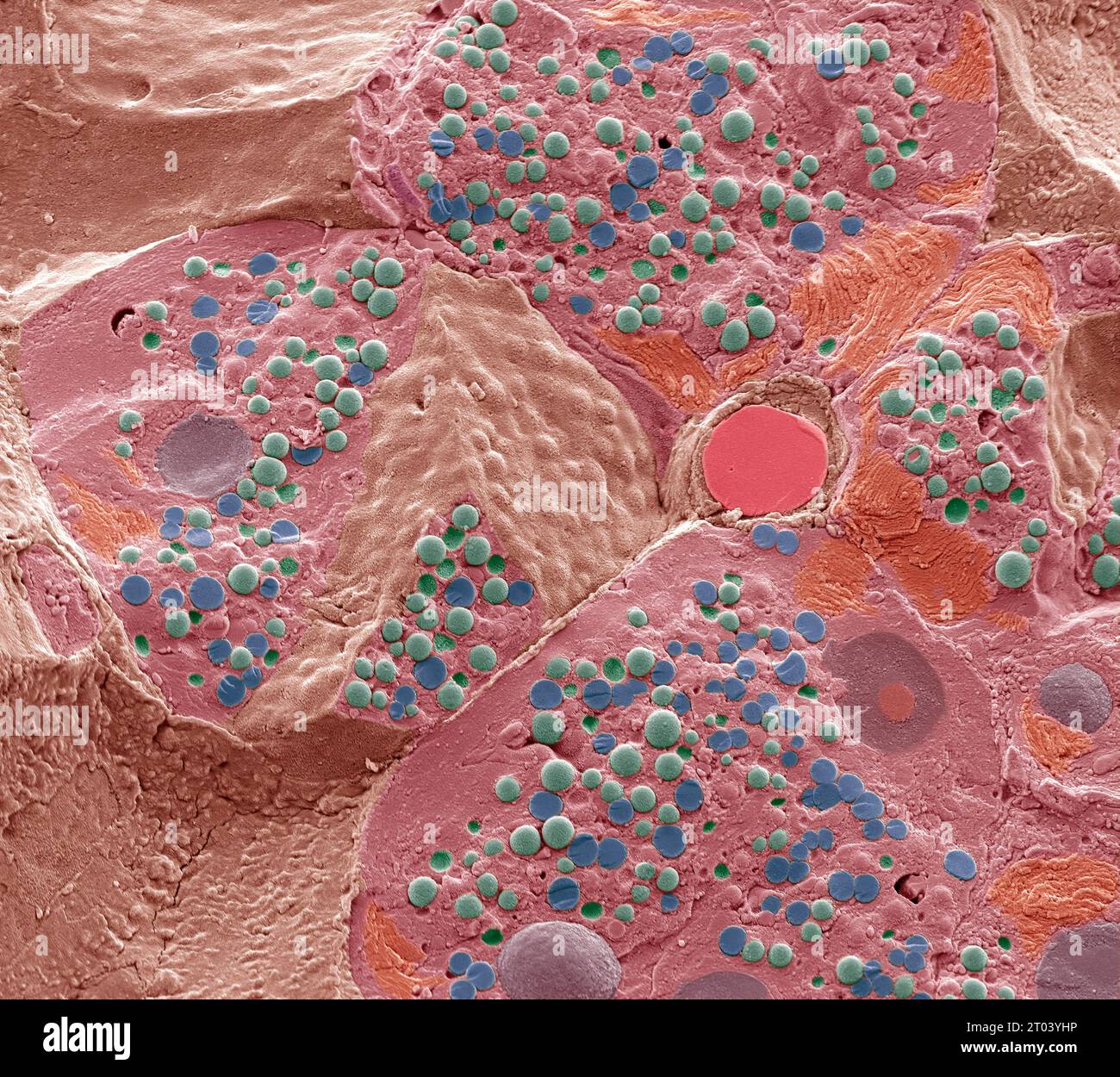 Pancreatic tissue. Scanning electron micrograph (SEM) of a freeze ...