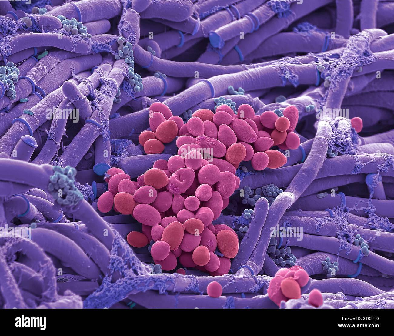 Oral fungi. Coloured scanning electron micrograph (SEM) of a culture ...